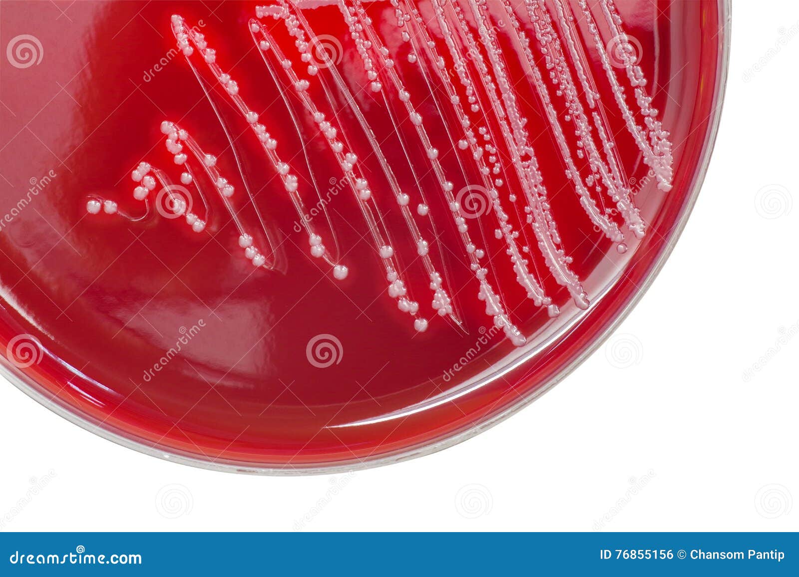 Streptococcus Bacterial Colonies With Alpha Hemolytic On Blood A ... Streptococcus Bacterial Colonies With Alpha Hemolytic On Blood A ...