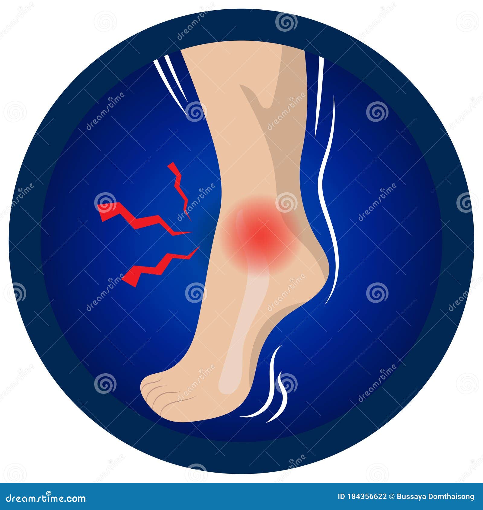 Ankle Strain and Sprain Icon. Vector Flat Design for Radiology ...