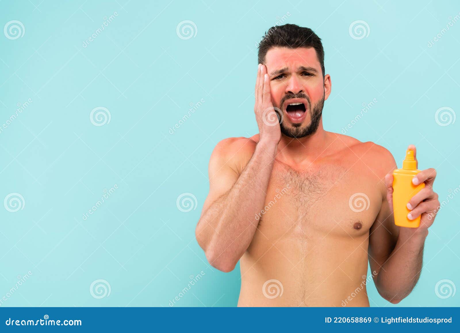 Stressed Shirtless Man With Sunburn Holding Stock Image Image Of Skin