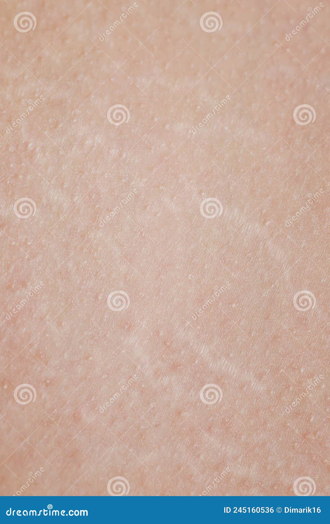 Stretch On Human Skin Background Stock Image | CartoonDealer.com #223616617