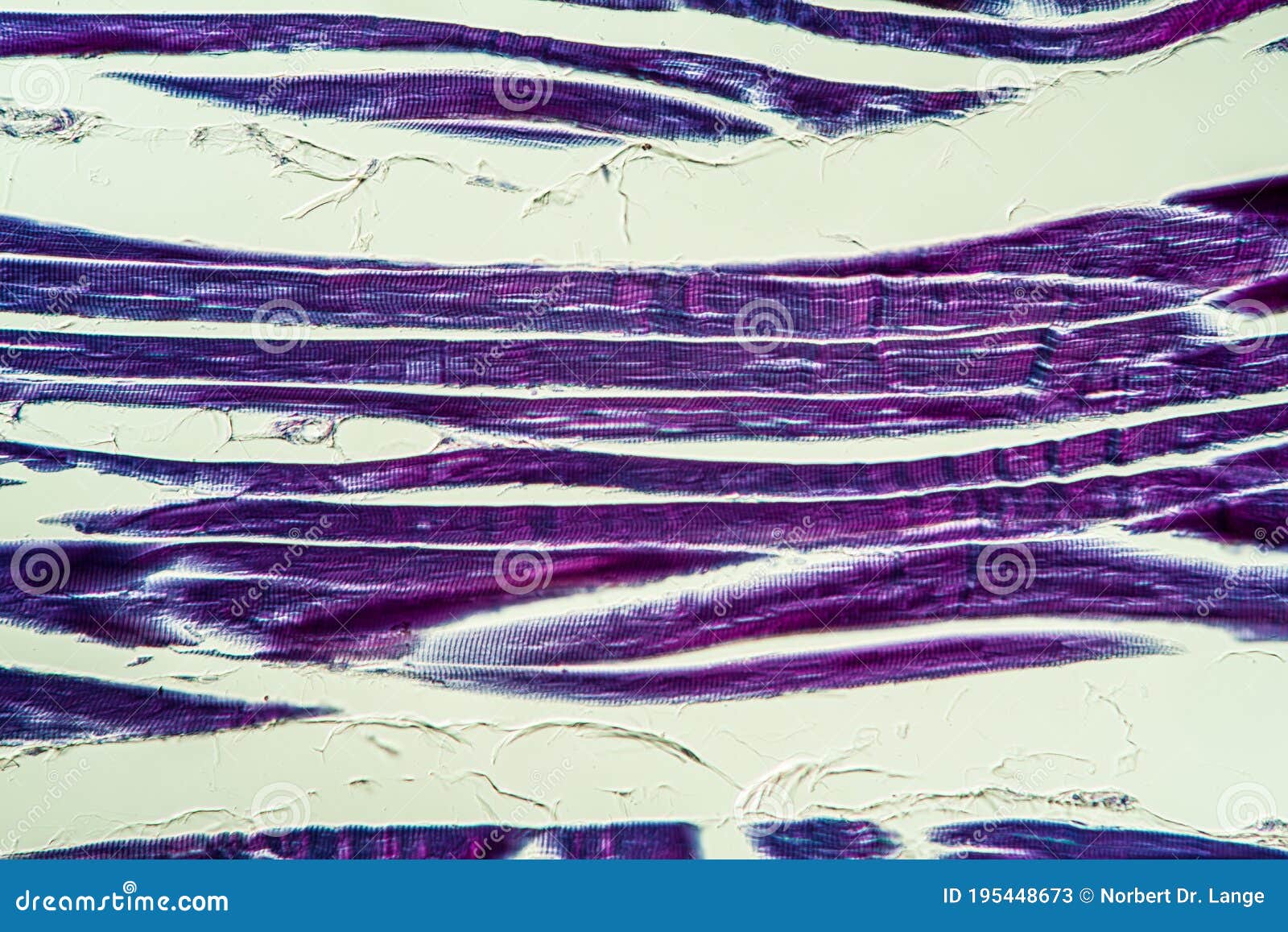 Striated Muscle Tissue Under the Microscope Stock Image - Image of ...