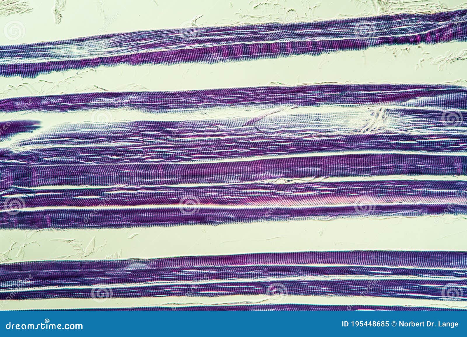 Striated Muscle Tissue Under the Microscope Stock Image - Image of tiny ...