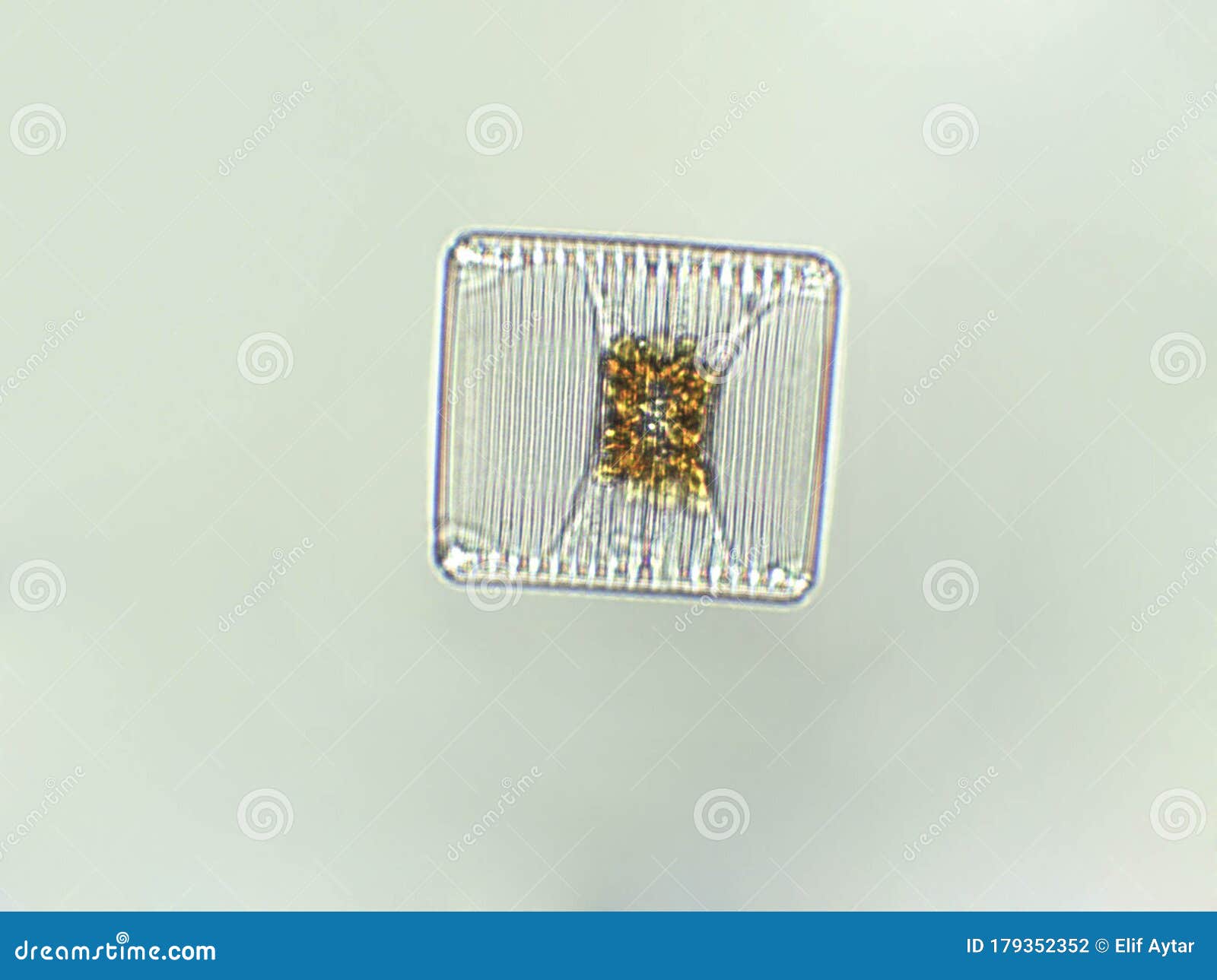 Striatella Sp. Algae Under Microscopic View Stock Photo - Image of ...