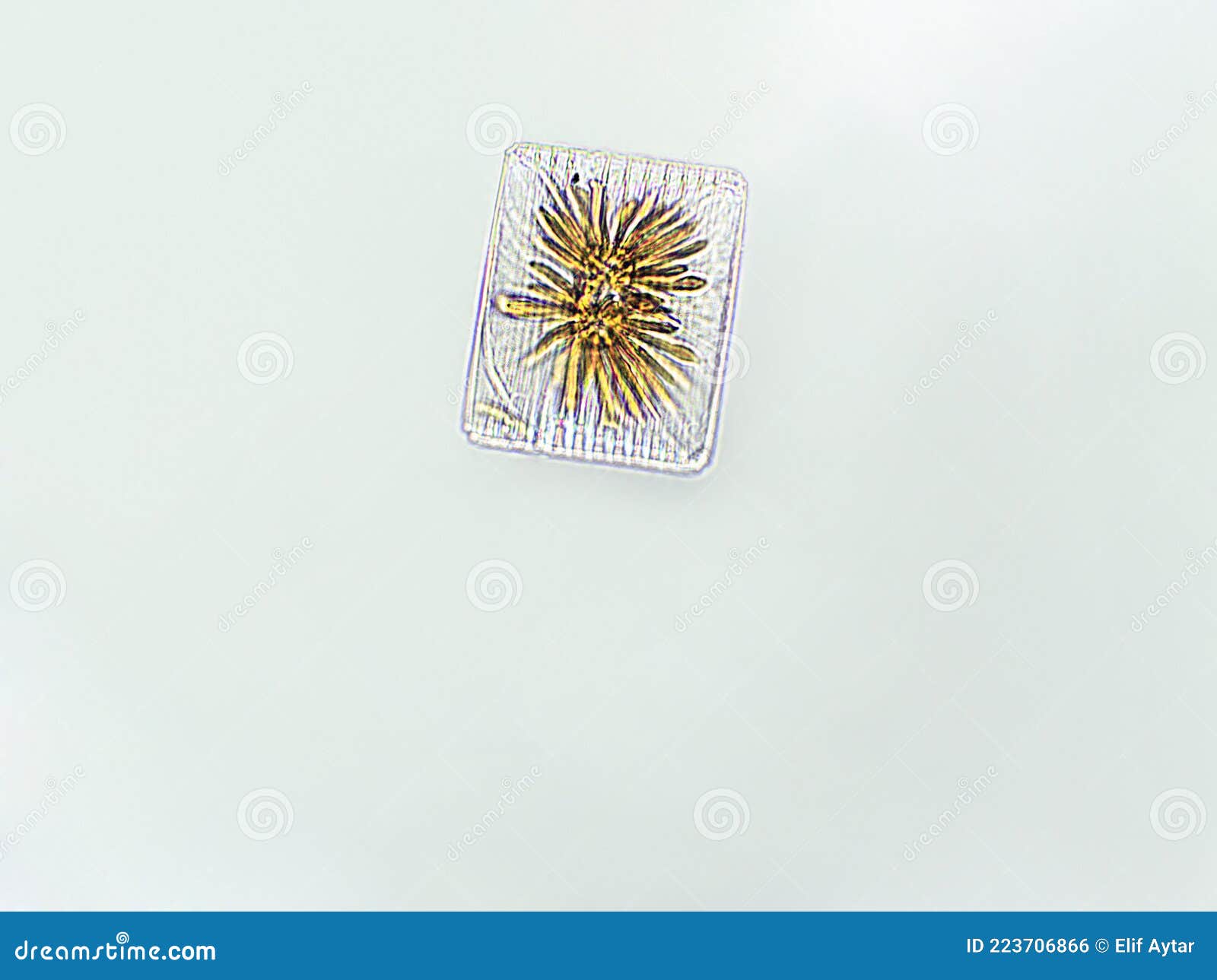 Striatella Sp. Algae Under Microscopic View, Diatom Algae Stock Photo ...