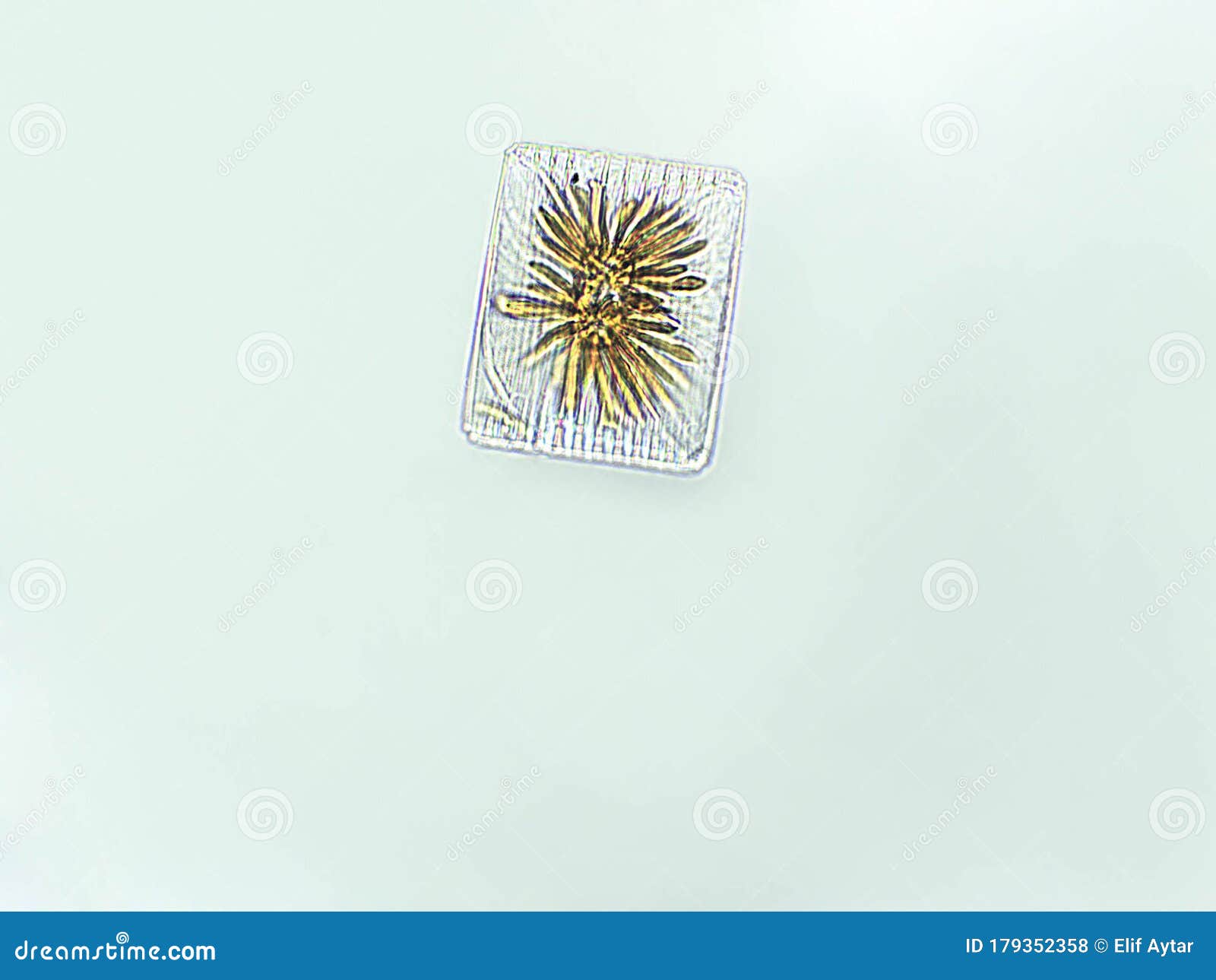 Striatella Unipunctata Algae Under Microscopic View Stock Photo - Image ...