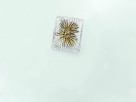 Striatella Unipunctata Algae Under Microscopic View Stock Photo - Image ...