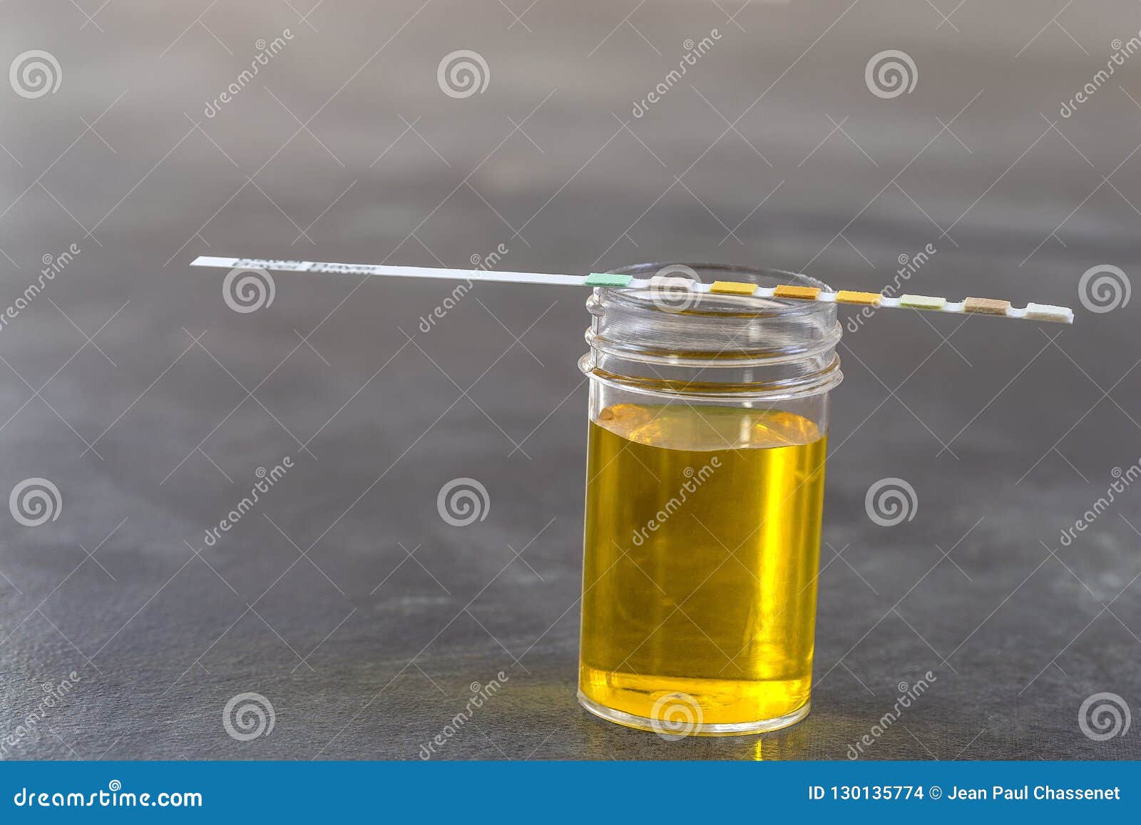 Strip of PH Paper Resting on Specimen, with Comparison Chart Box Stock ...