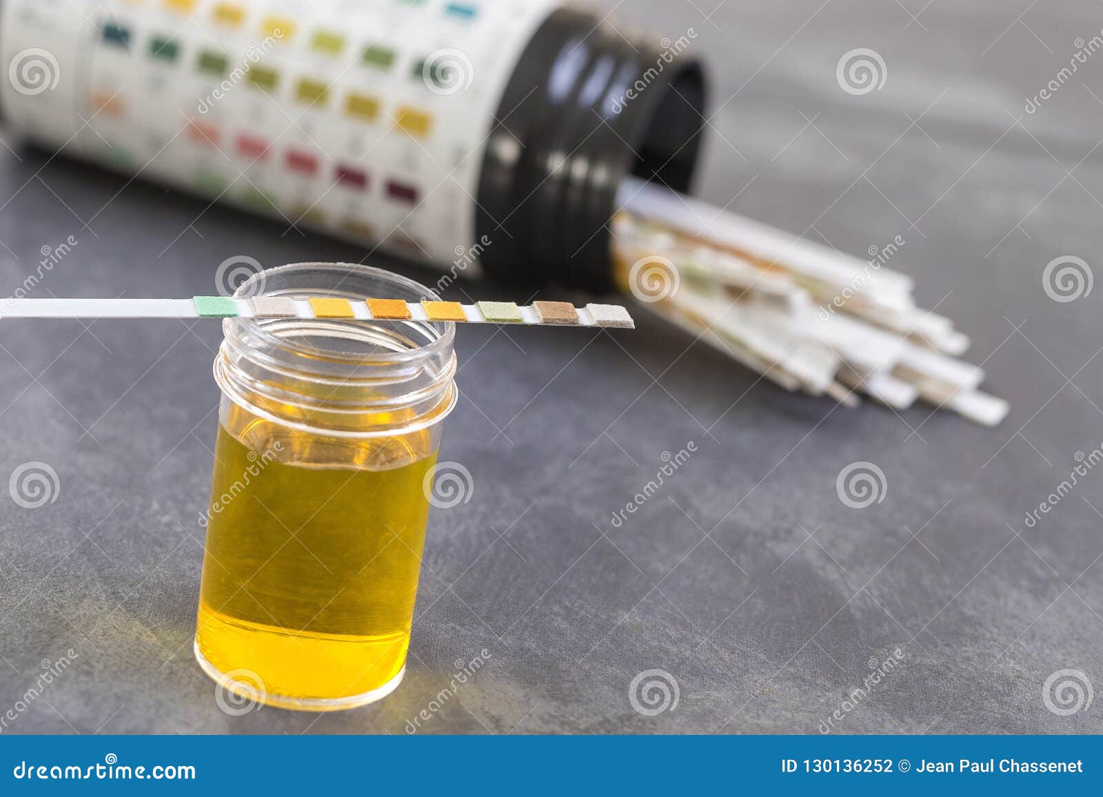 Strip of PH Paper Resting on Specimen, with Comparison Chart Box Stock ...