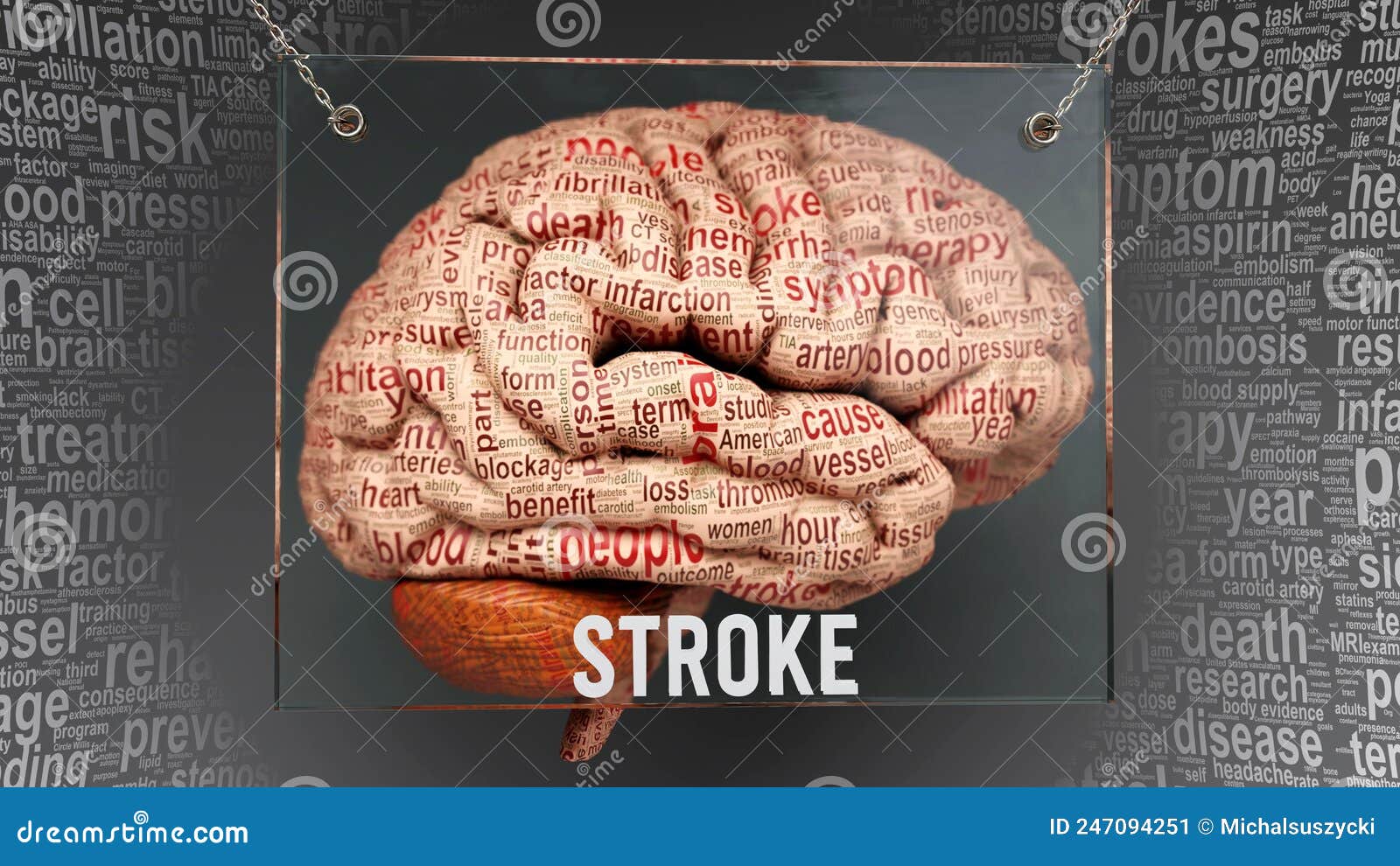 Stroke in human brain stock illustration. Illustration of mind - 247094251