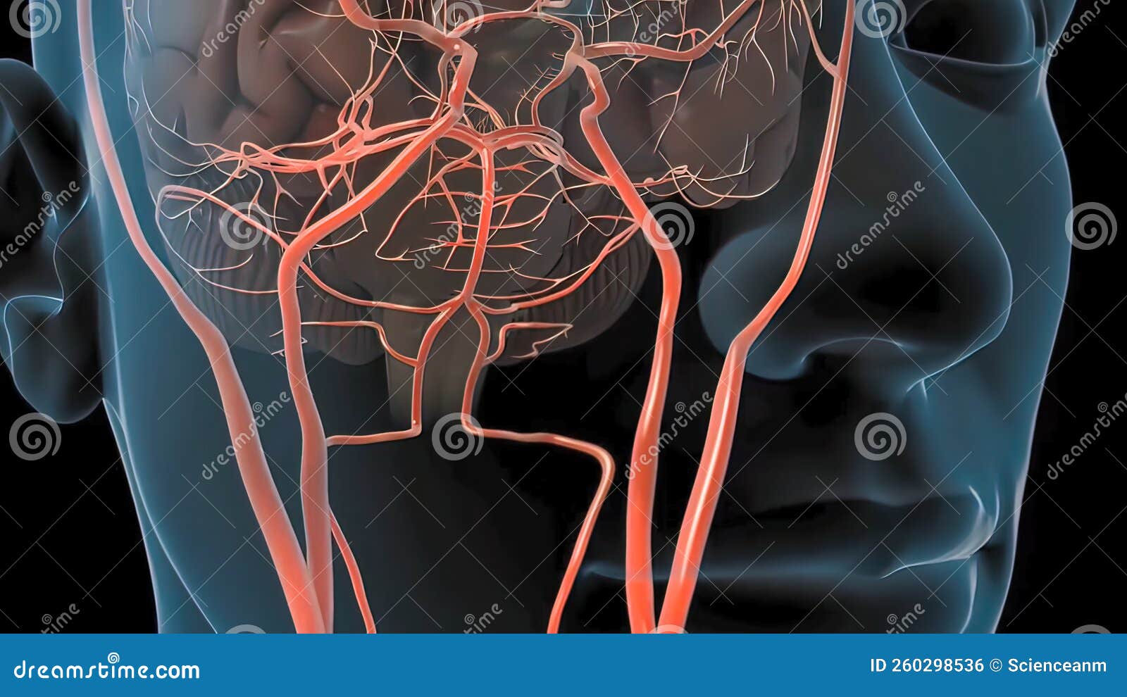 A Stroke, Sometimes Called a Brain Attack Stock Illustration ...