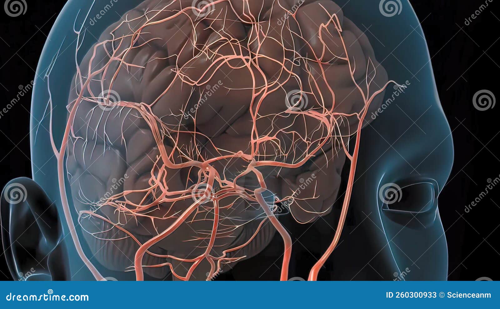 A Stroke, Sometimes Called a Brain Attack Stock Illustration ...