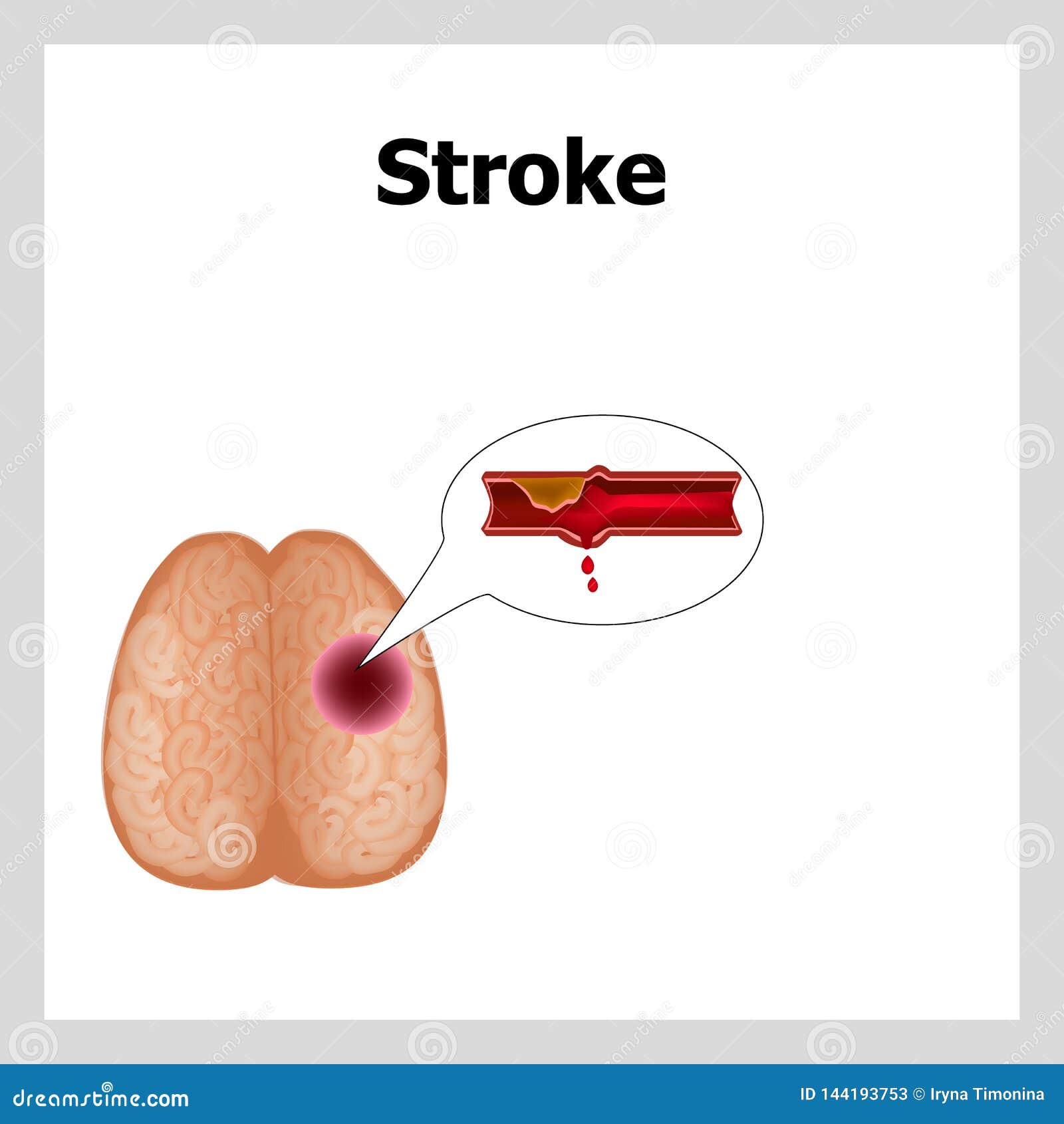 Structure Of The Brain Neuron Cartoon Vector | CartoonDealer.com #210961231