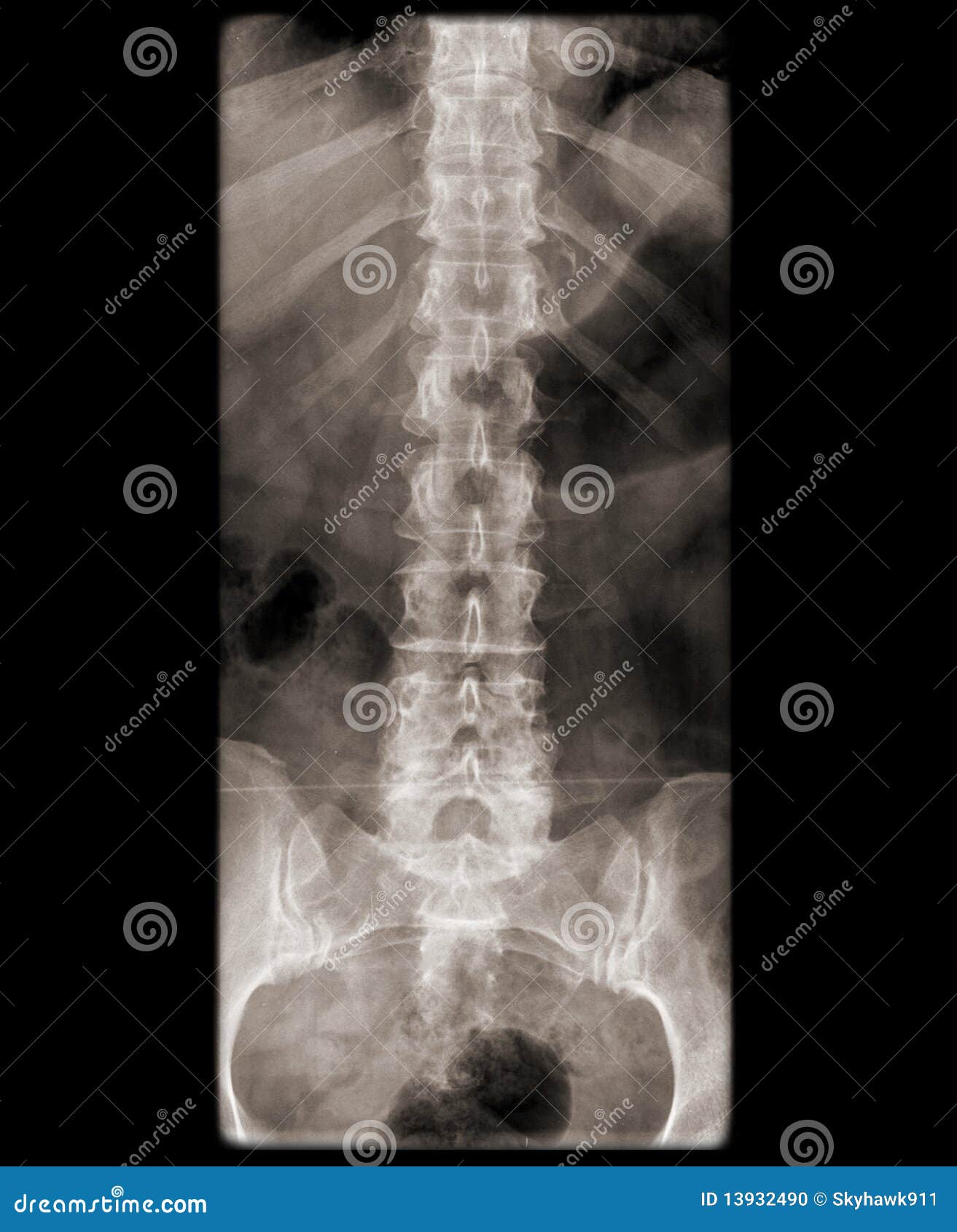 Strong spine on x-ray stock photo. Image of graphic, joint - 13932490