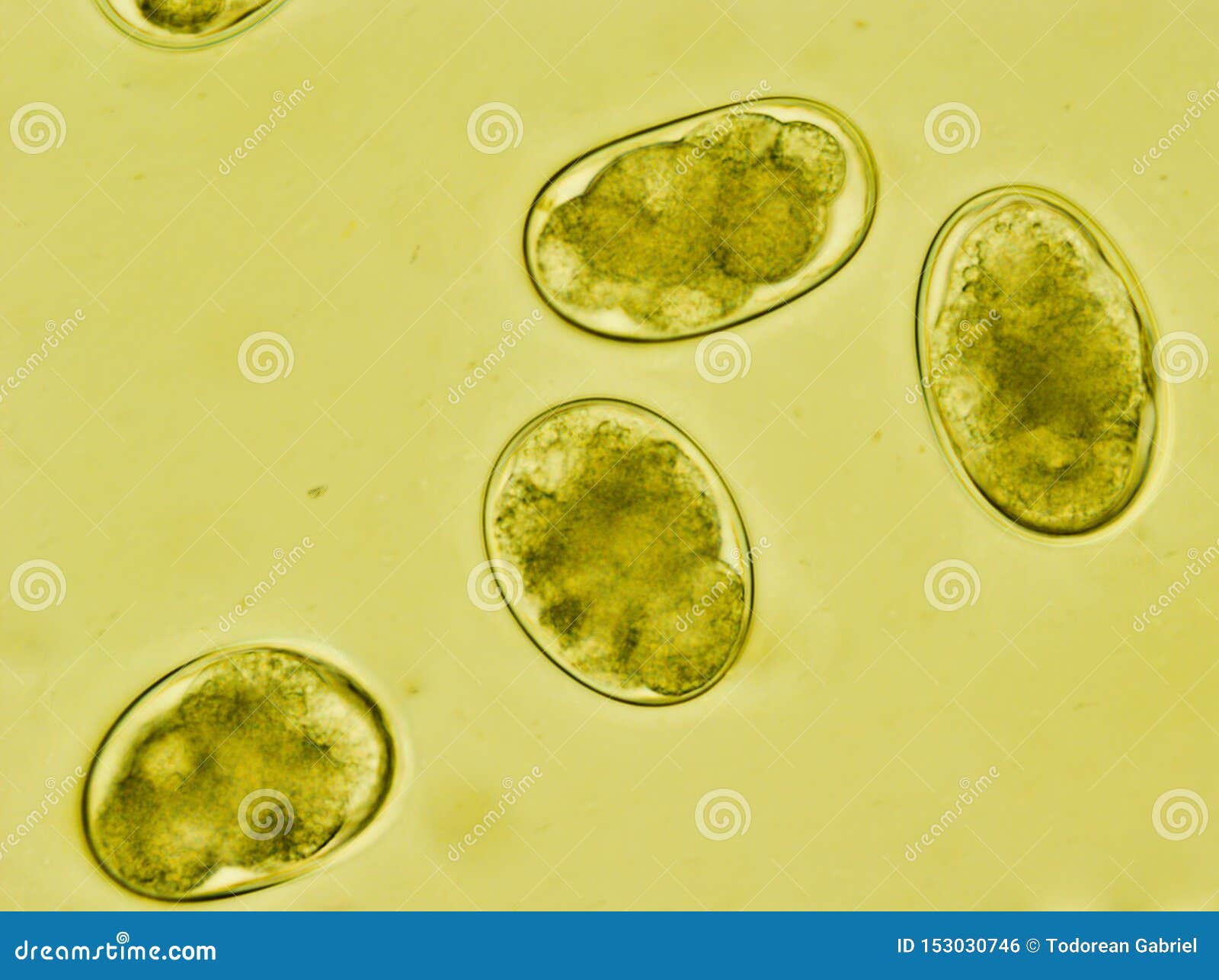 Strongyle Eggs Under the Microscope, Uncinaria/Ancylostoma, Hookworm ...