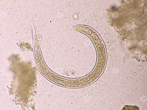 Strongyloides Stercoralis in Human Stool Stock Image - Image of ...