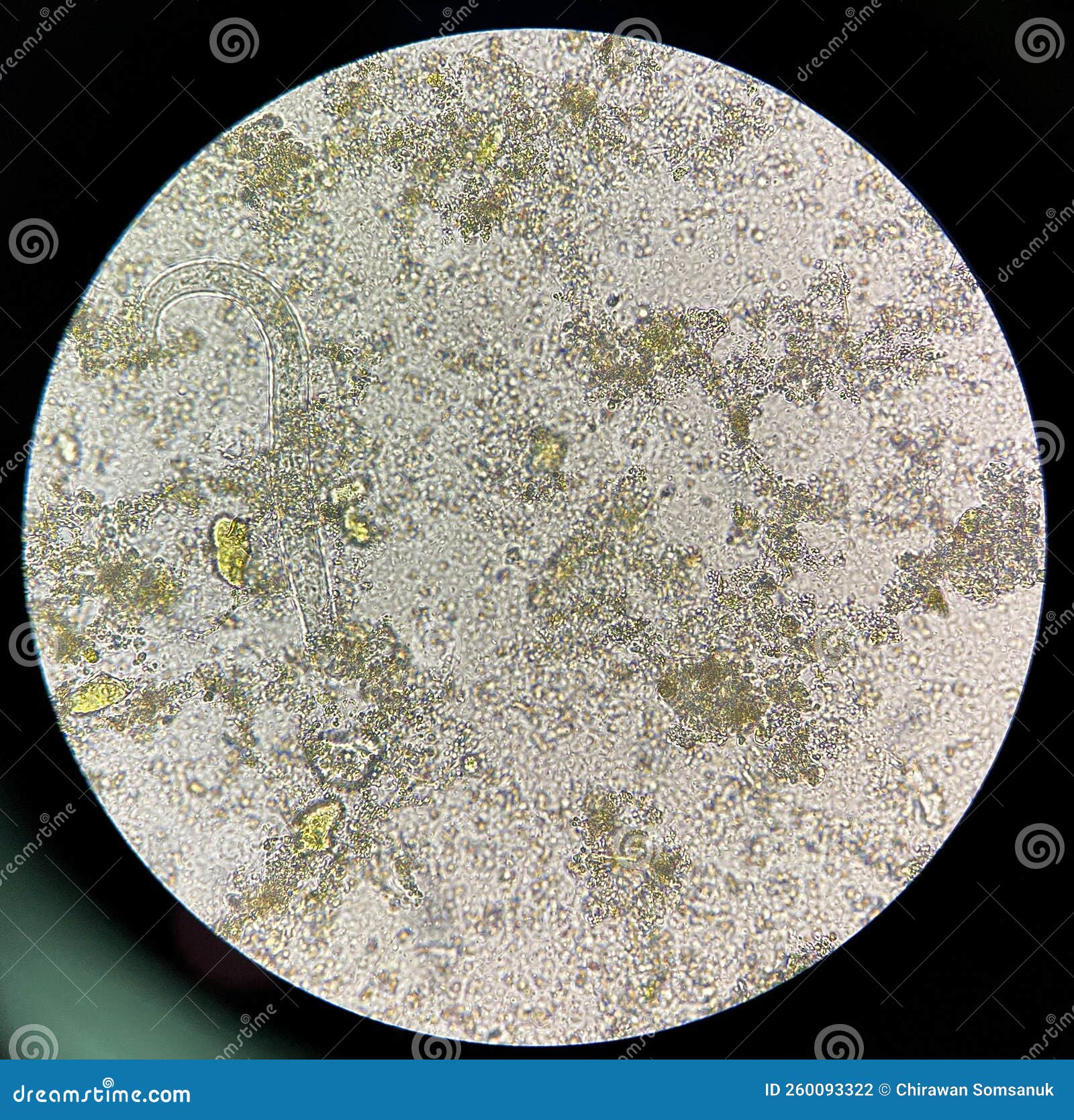 Strongyloides Stercoralis Larva in Stool Exam Stock Photo - Image of ...