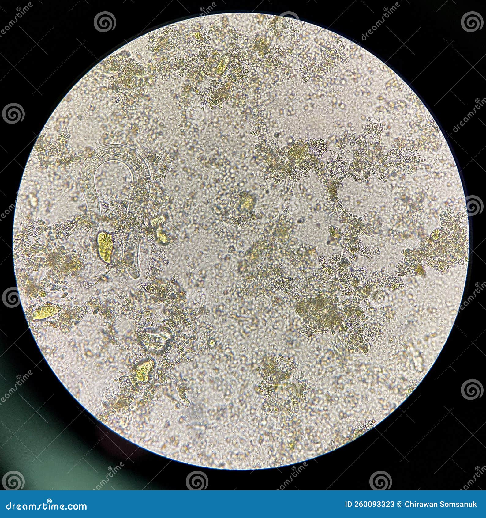 Strongyloides Stercoralis Larva in Stool Exam Stock Image - Image of ...