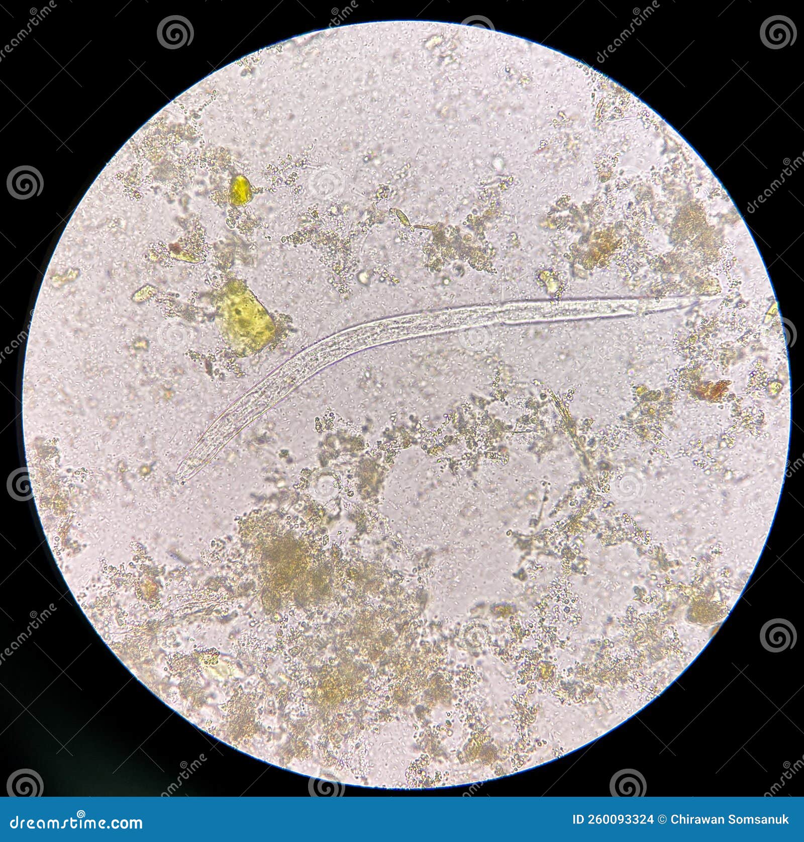 Strongyloides Stercoralis Larva in Stool Exam Stock Photo - Image of ...