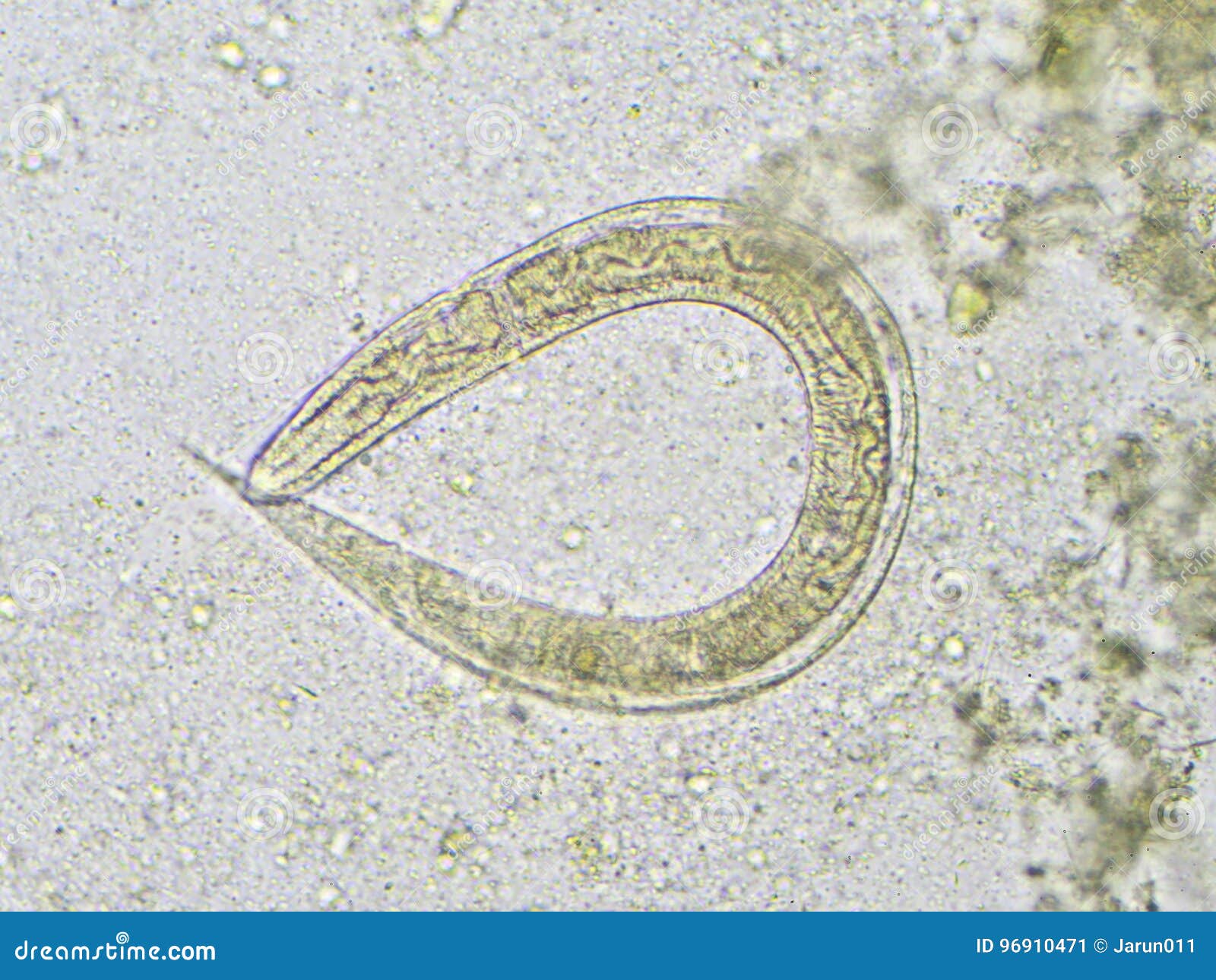Strongyloides Stercoralis Or Threadworm In Human Stool Stock Photo ...