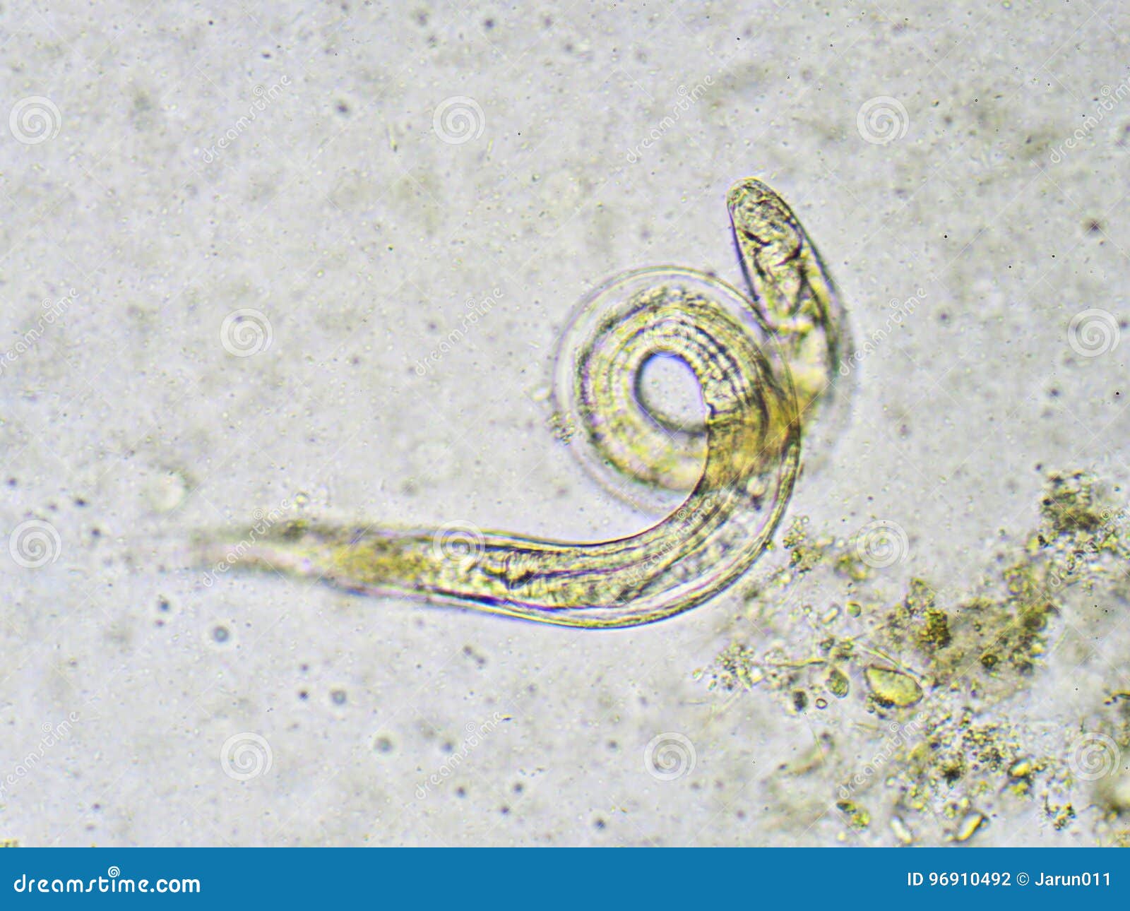 Strongyloides Stercoralis Or Threadworm In Human Stool Royalty-Free ...