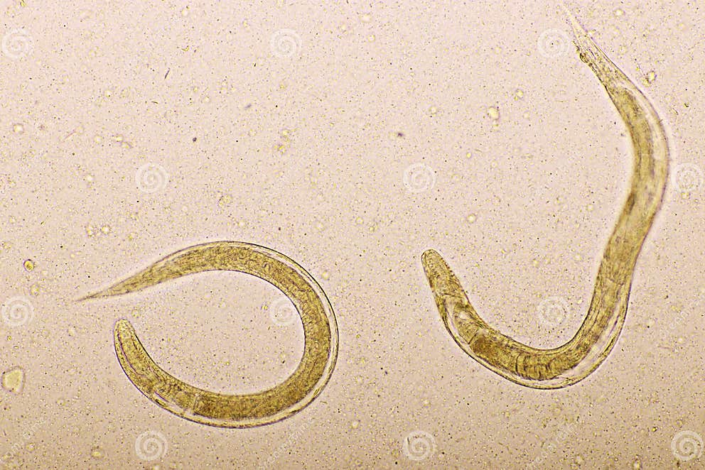 Strongyloides Stercoralis or Threadworm in Human Stool Stock Photo ...