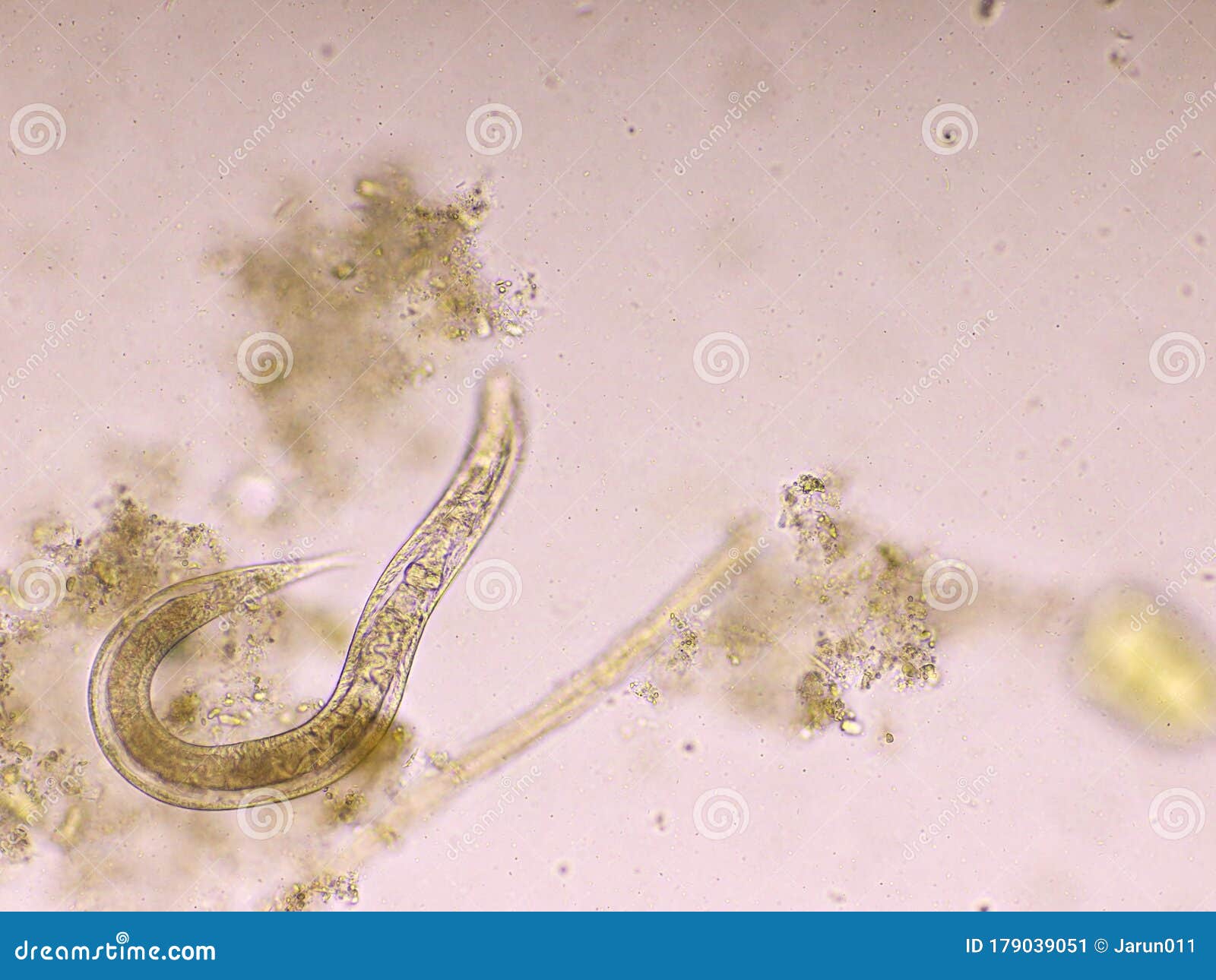 Strongyloides Stercoralis or Threadworm in Human Stool Stock Image ...