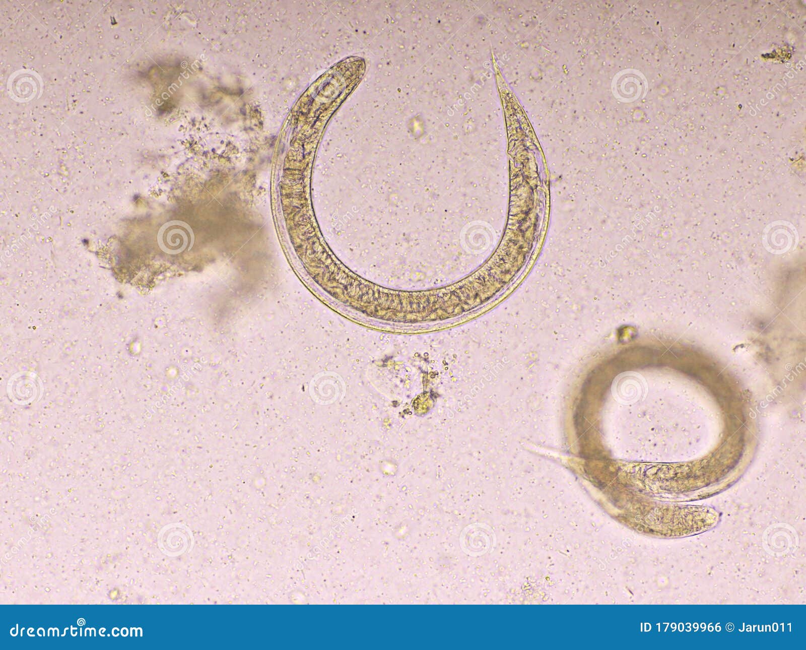 Strongyloides Stercoralis or Threadworm in Human Stool Stock Photo ...