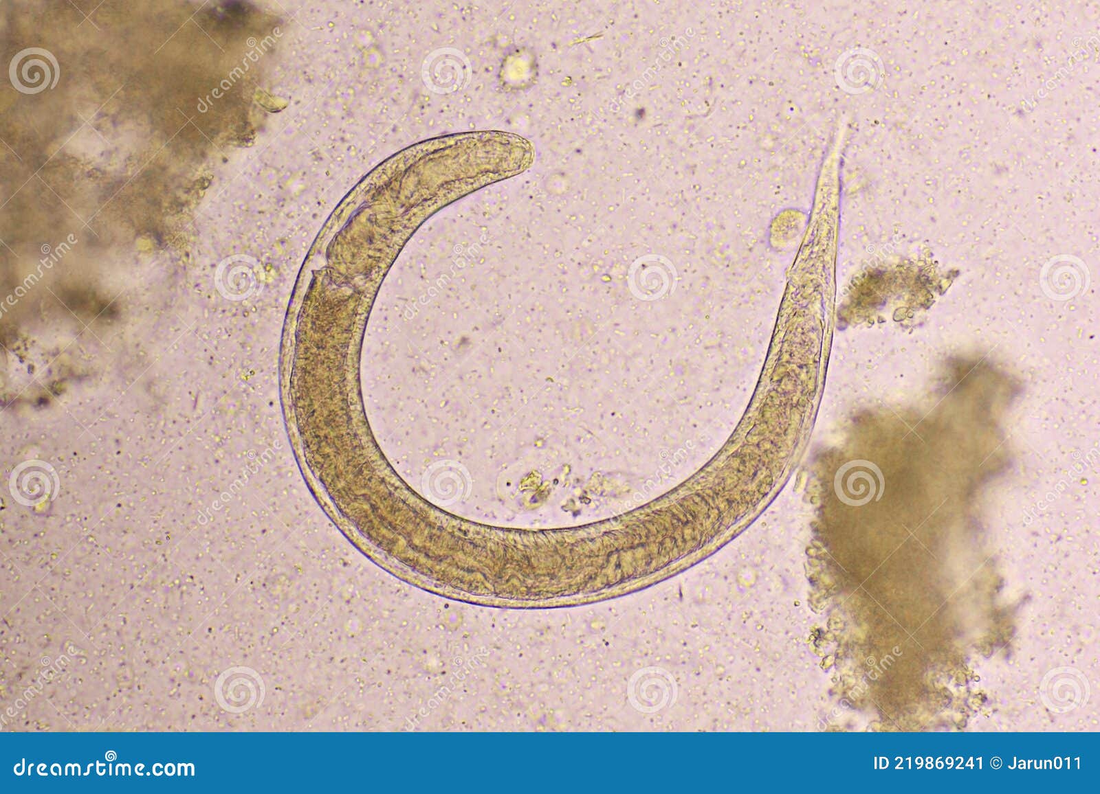 Strongyloides Stercoralis or Threadworm in Human Stool Stock Image ...