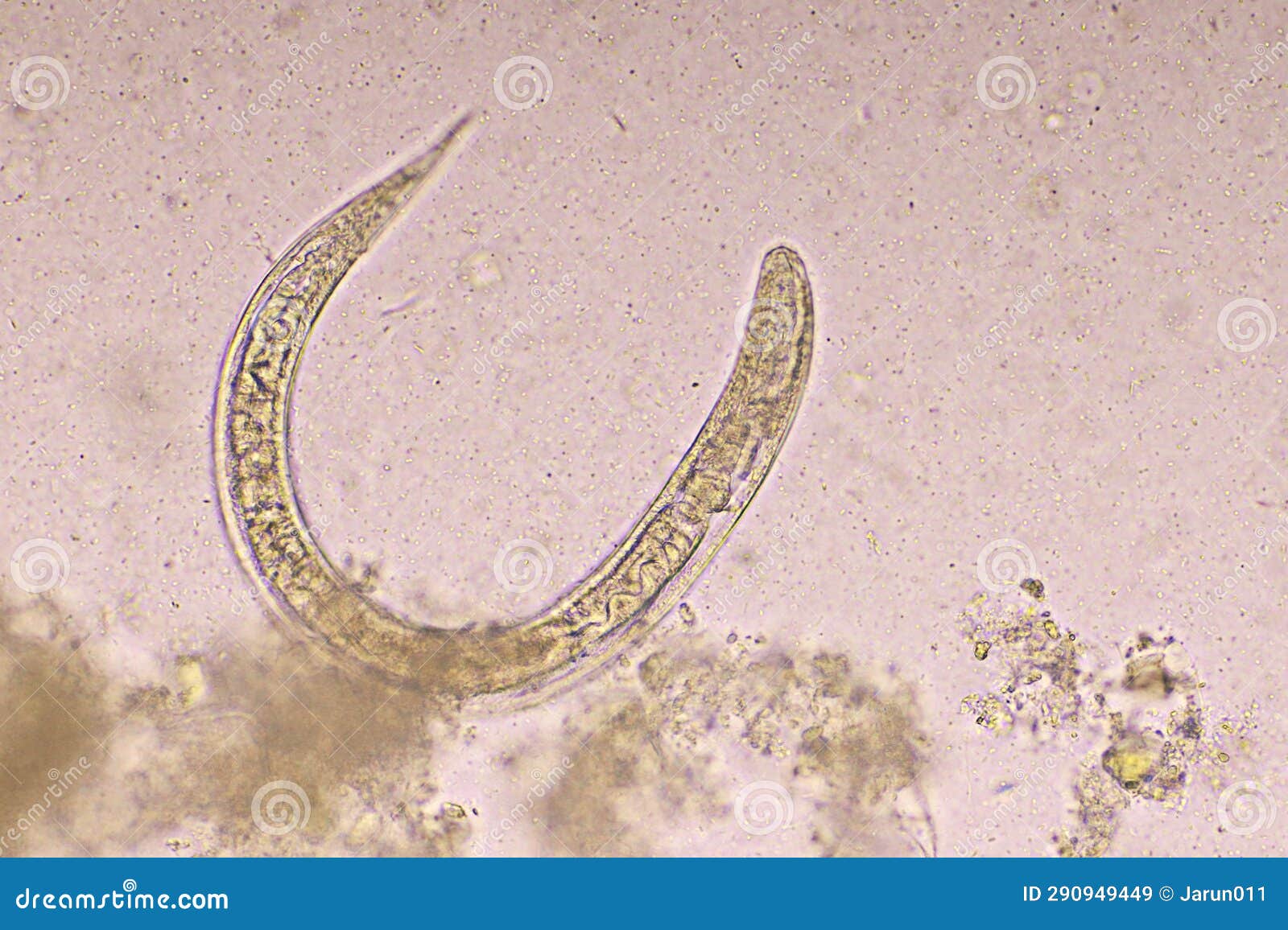 Strongyloides Stercoralis or Threadworm Stock Image - Image of diarrhea ...