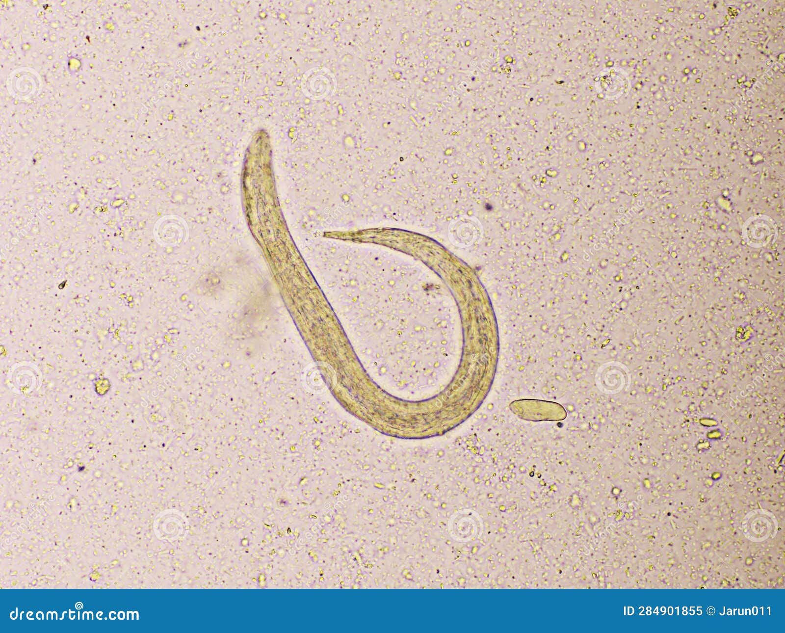 Strongyloides Stercoralis or Threadworm in Human Stool Stock Image ...