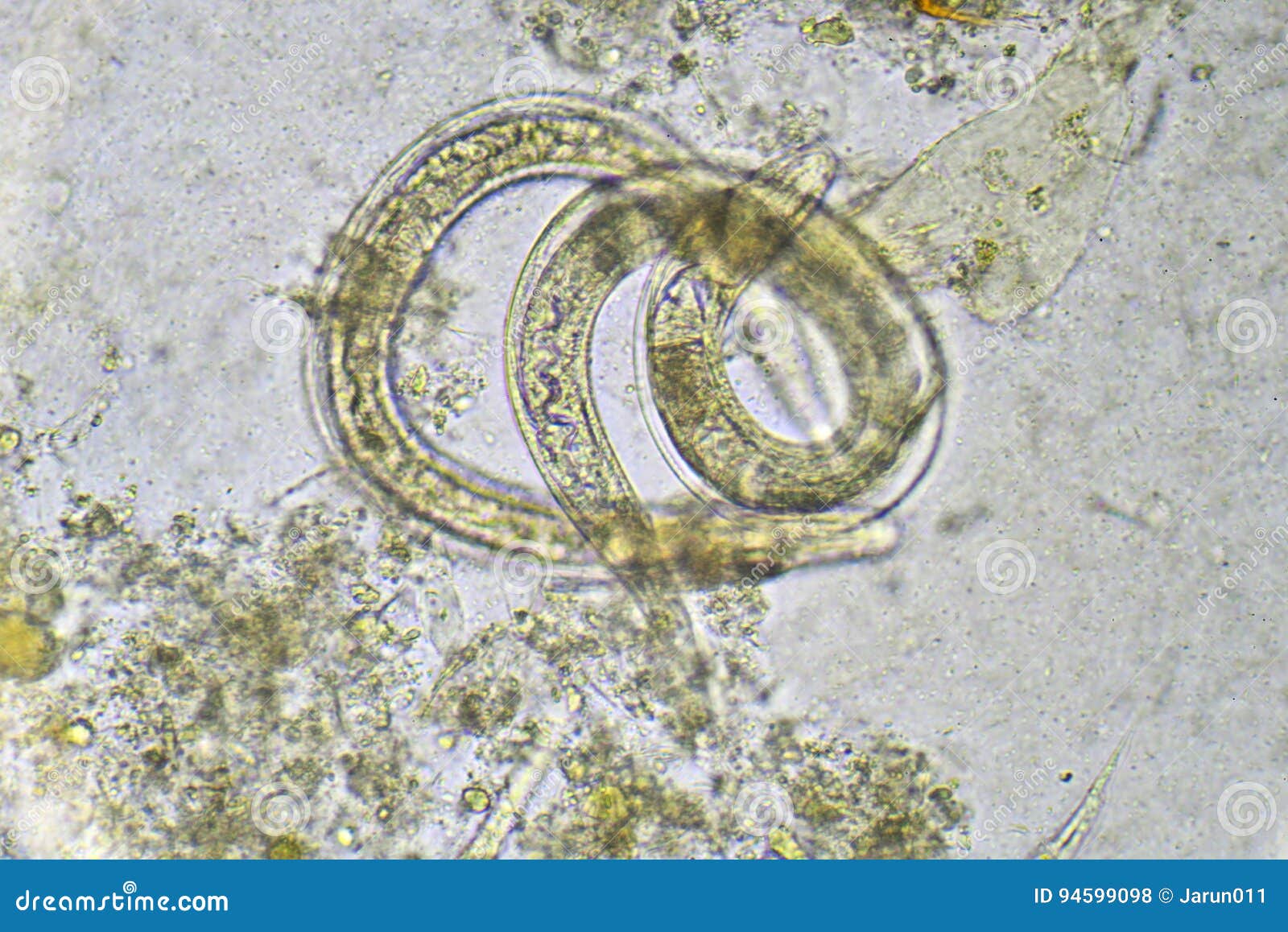 Strongyloides Stercoralis Or Threadworm In Human Stool Stock Photo ...