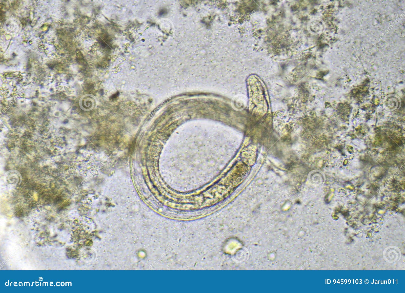 Strongyloides Ransomi Egg