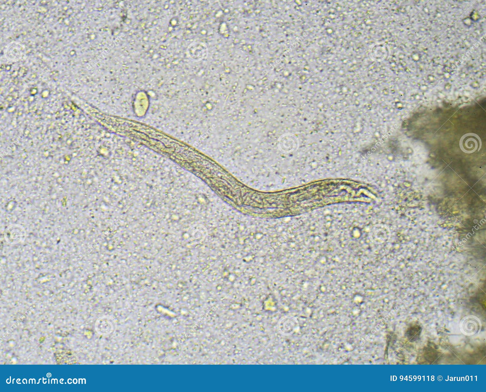 Strongyloides stercoralis stock photo. Image of protozoa - 94599118