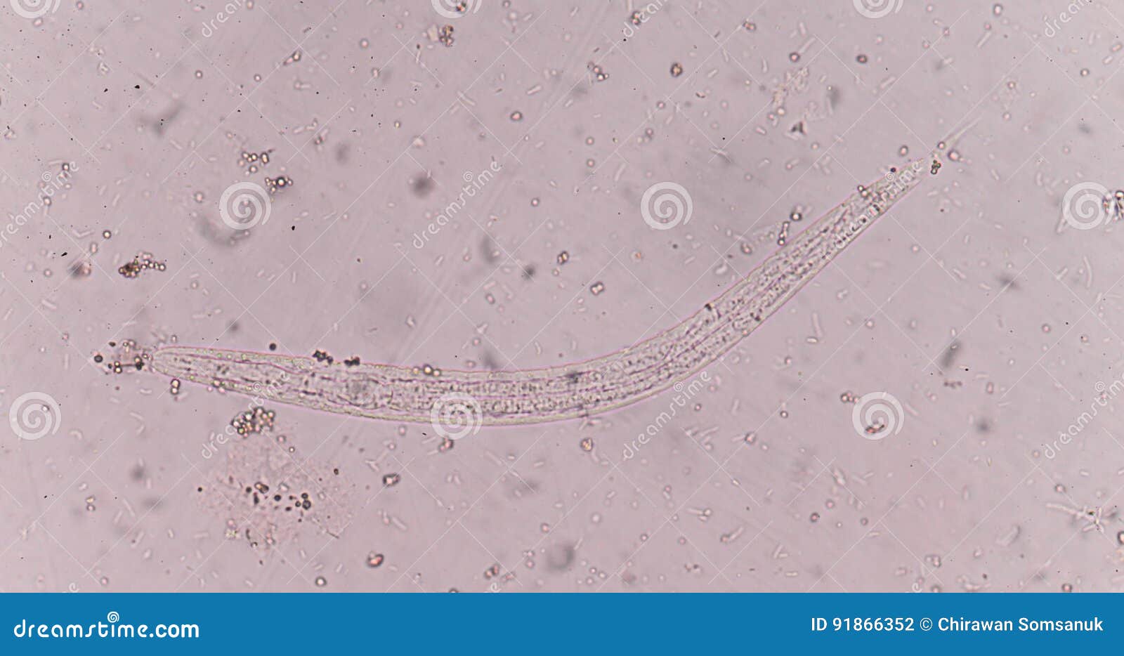 Strongyloides Stercoralis Threadworm in Stool, Stock Photo - Image of ...