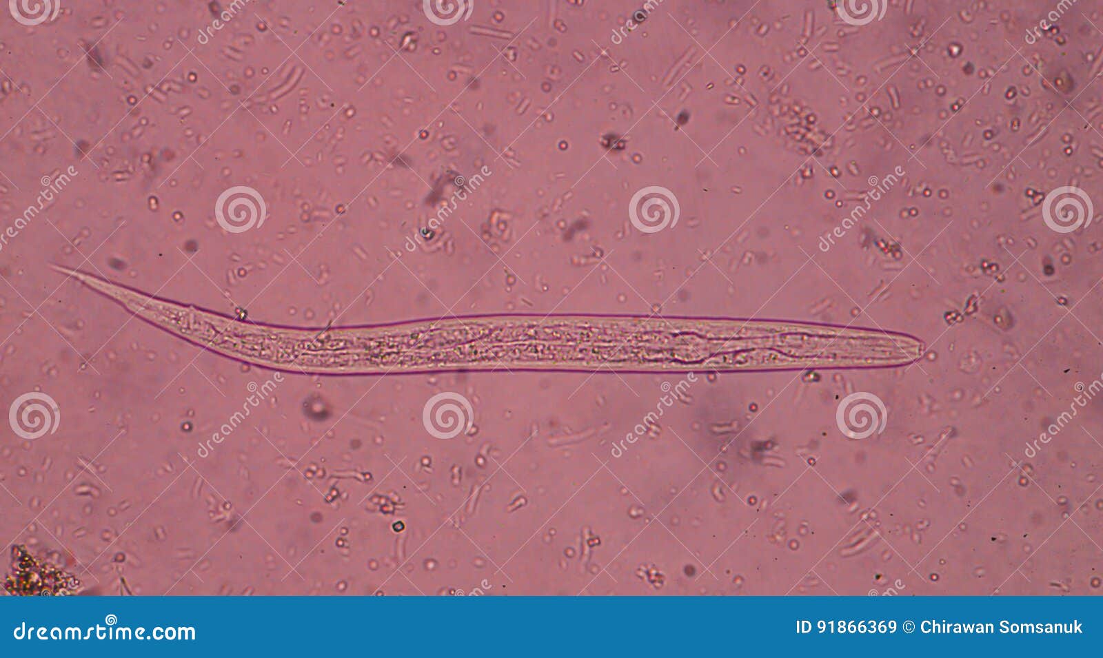 Strongyloides stercoralis stock image. Image of protozoa - 91866369