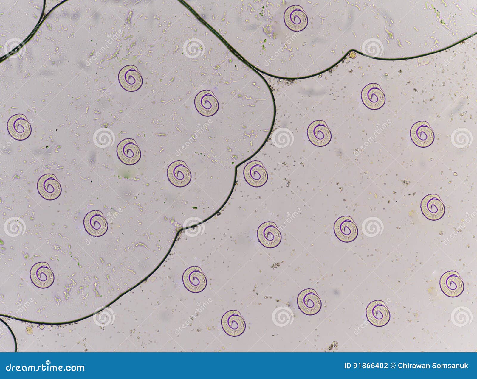 Strongyloides stercoralis stock photo. Image of microscopy - 91866402