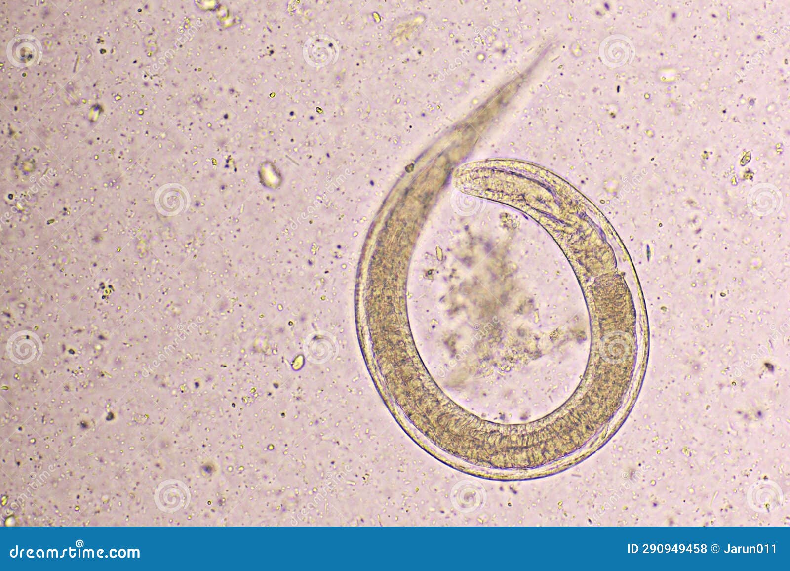 Strongyloides Stercoralis or Threadworm Stock Photo - Image of larva ...