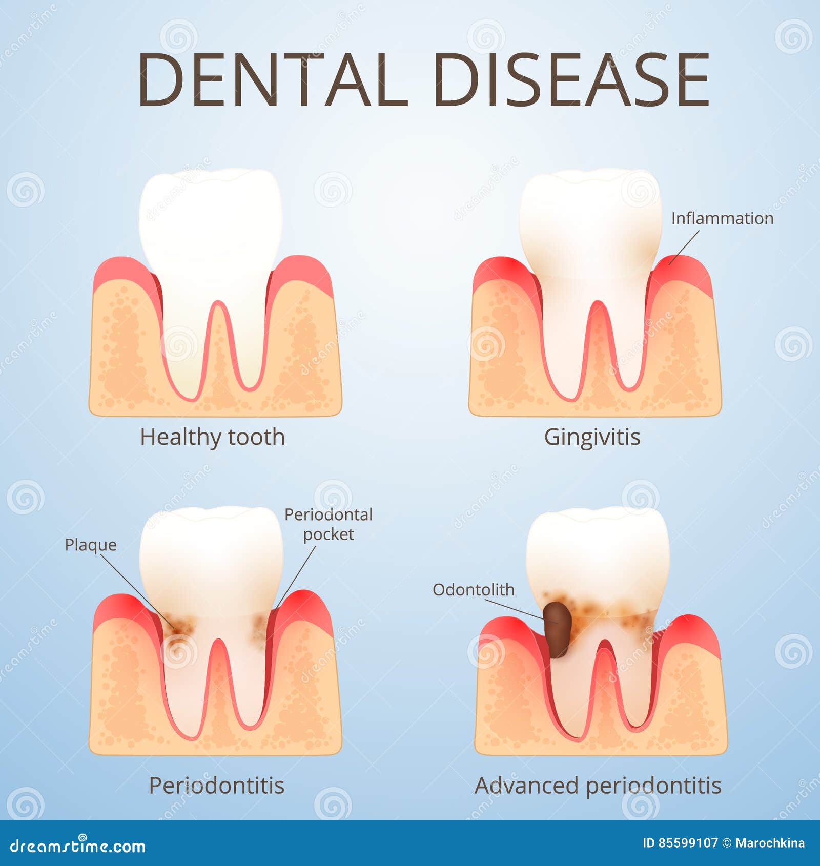 Structure Des Dents Humaines Illustration de Vecteur - Illustration du ...