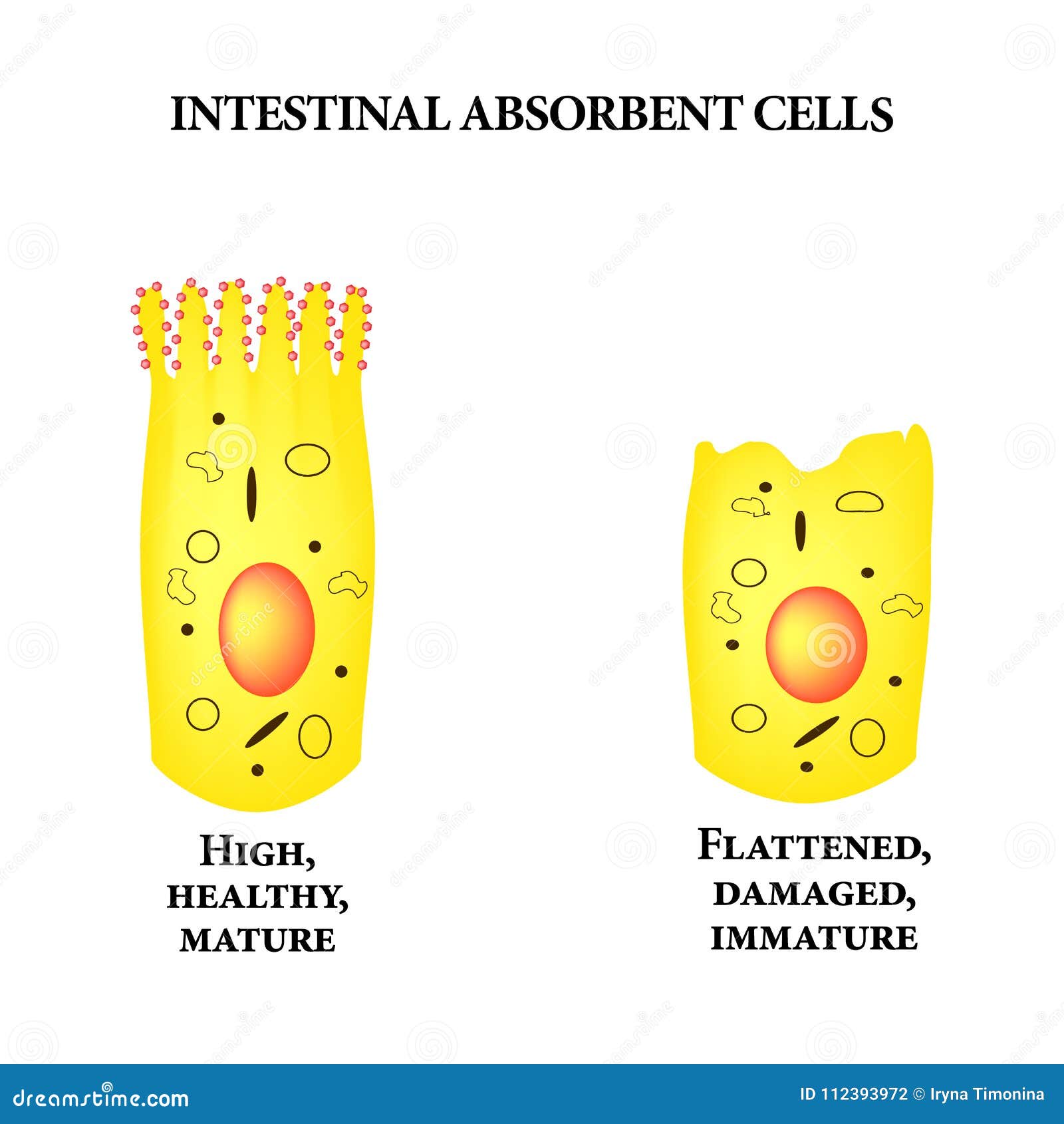 Structure of the Enterocyte. Deformed, Sick Cell. Absorptive Cells ...