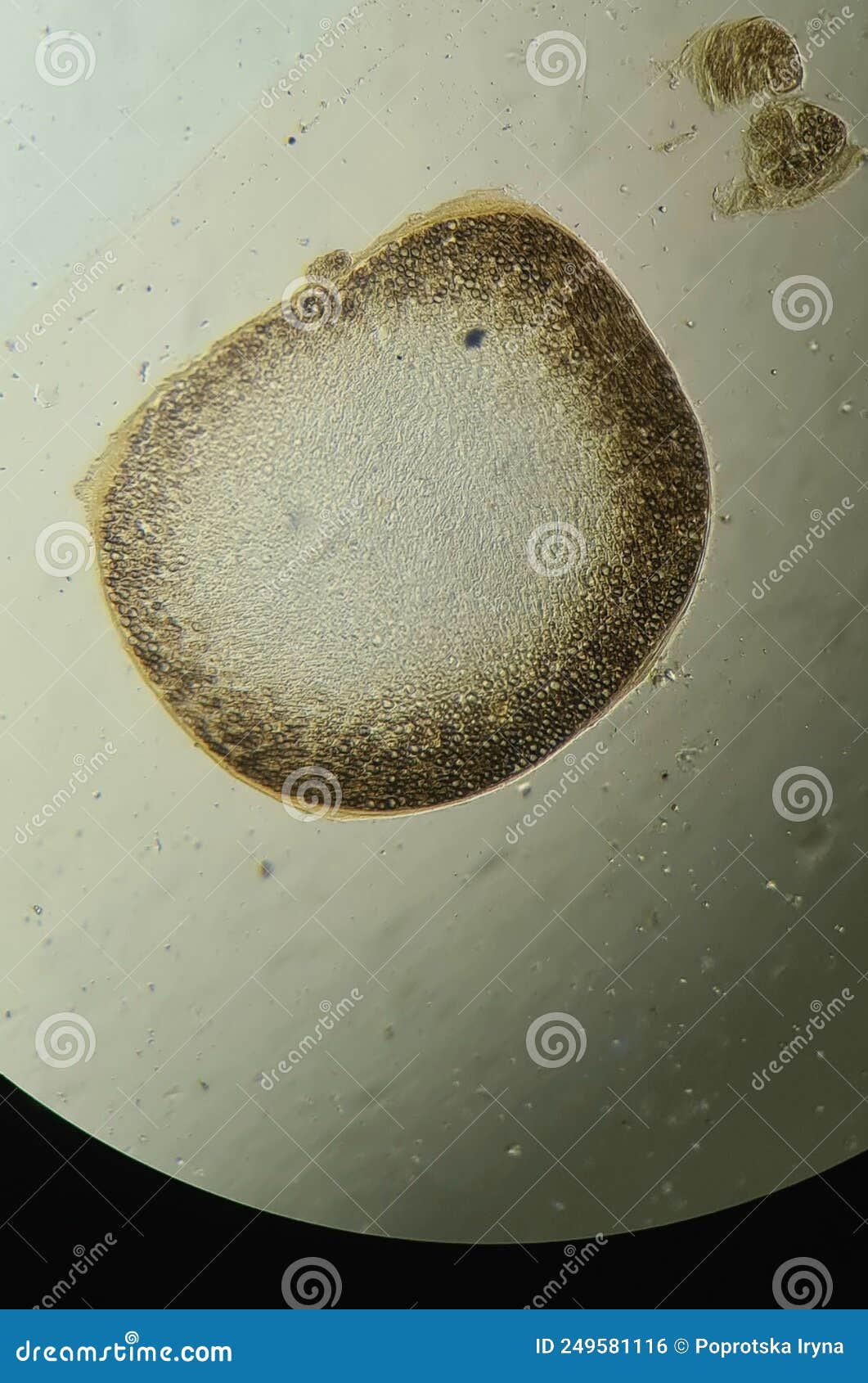 The Structure of the Myelin Nerve Fiber Under the Microscope Stock ...