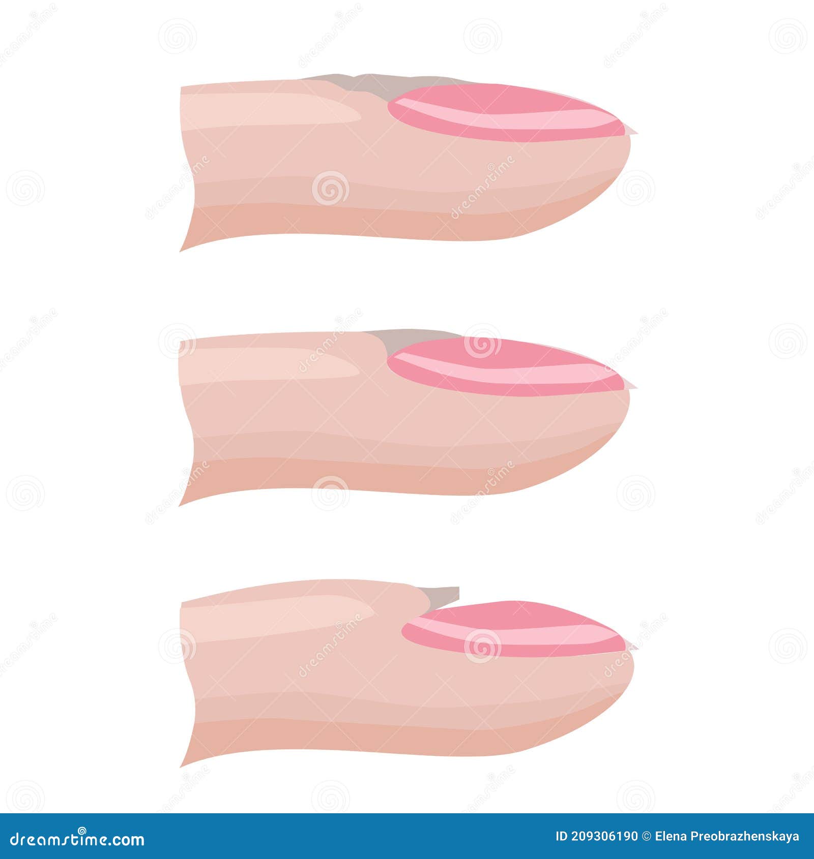 The Structure of the Nail, Types of Nail Cuticle. Hand Nail Care ...