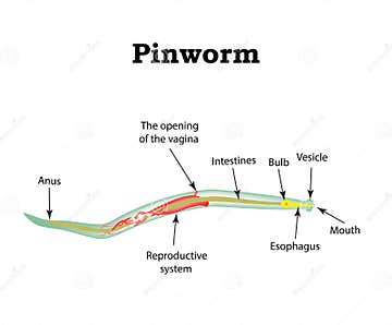 The Structure of Pinworms. Pinworm Stock Vector - Illustration of ...