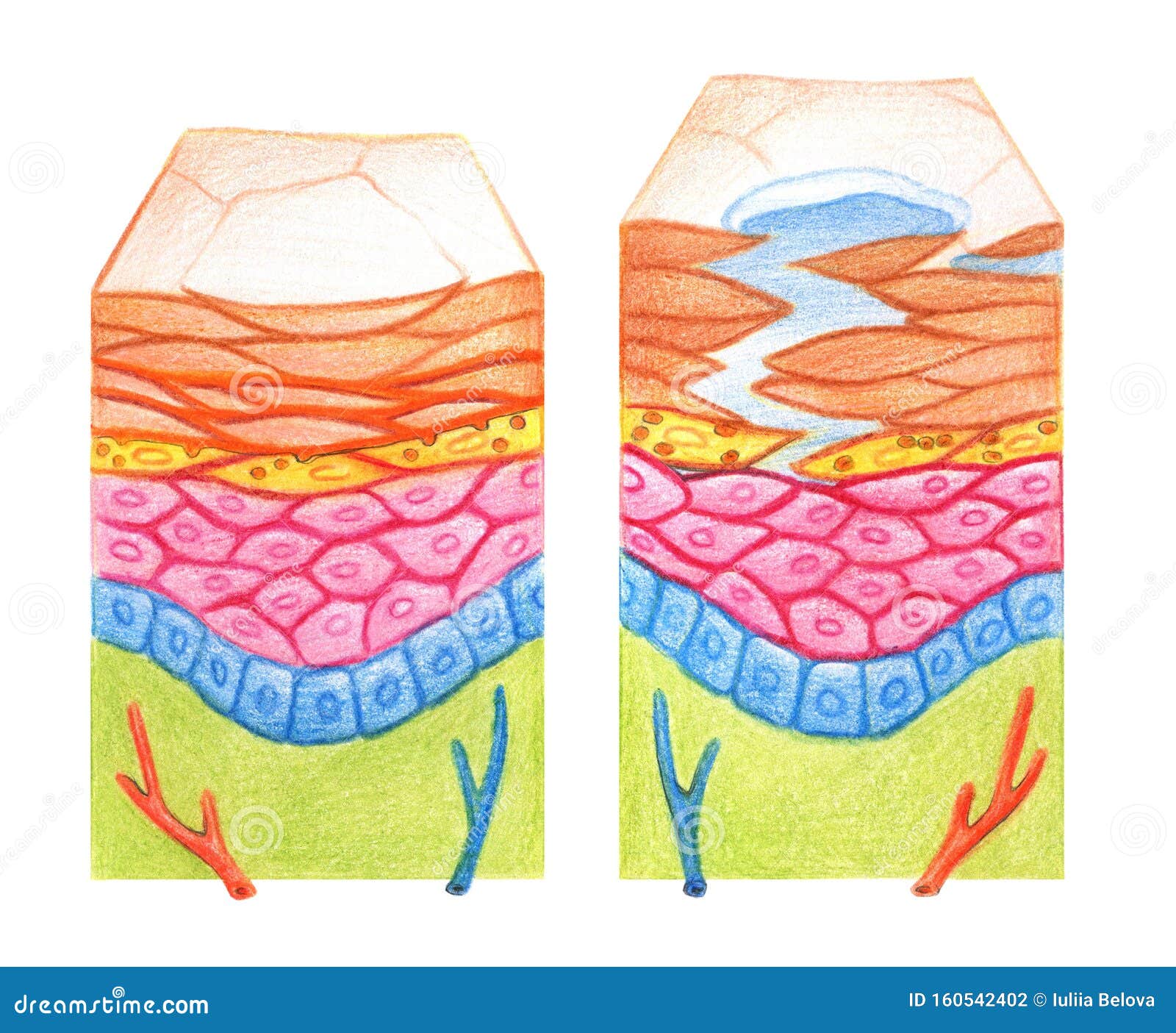 Dry Skin, Structure of Skin with Dry Problem on White Background Stock ...