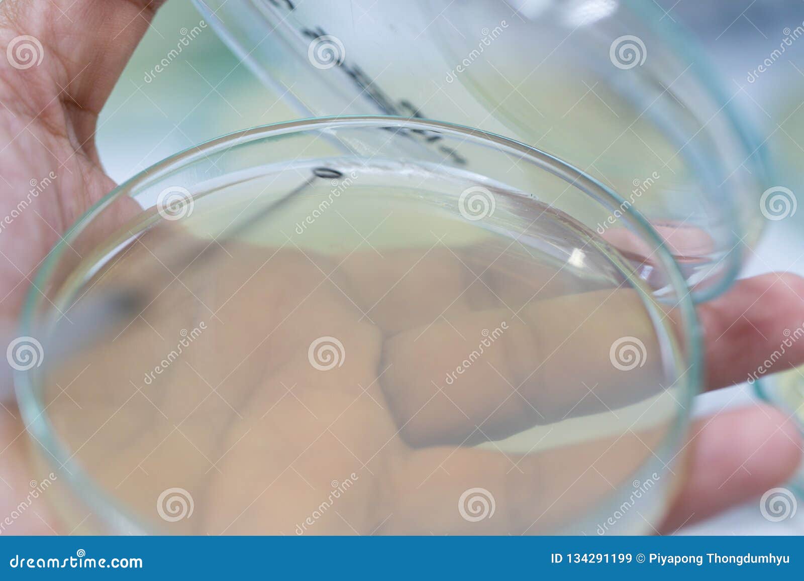 Study for Bacteria Staphylococcus Aureus in the Human Nose. Stock Image ...