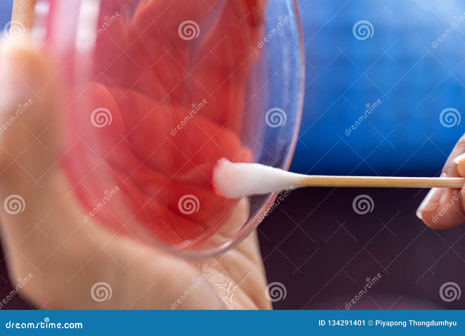 Study for Bacteria Staphylococcus Aureus in the Human Nose. Stock Image ...