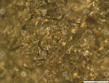 Structure of Titanium Under a Microscope. Stock Photo - Image of ...