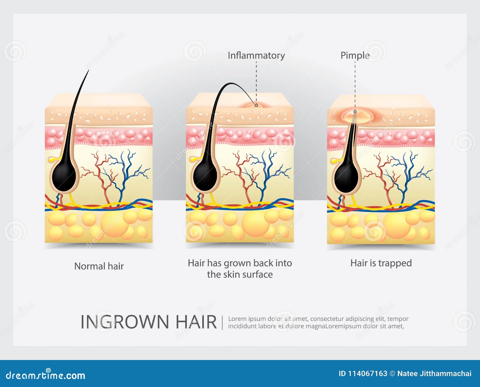 Struttura Del Pelo Incarnito Illustrazione Vettoriale - Illustrazione ...