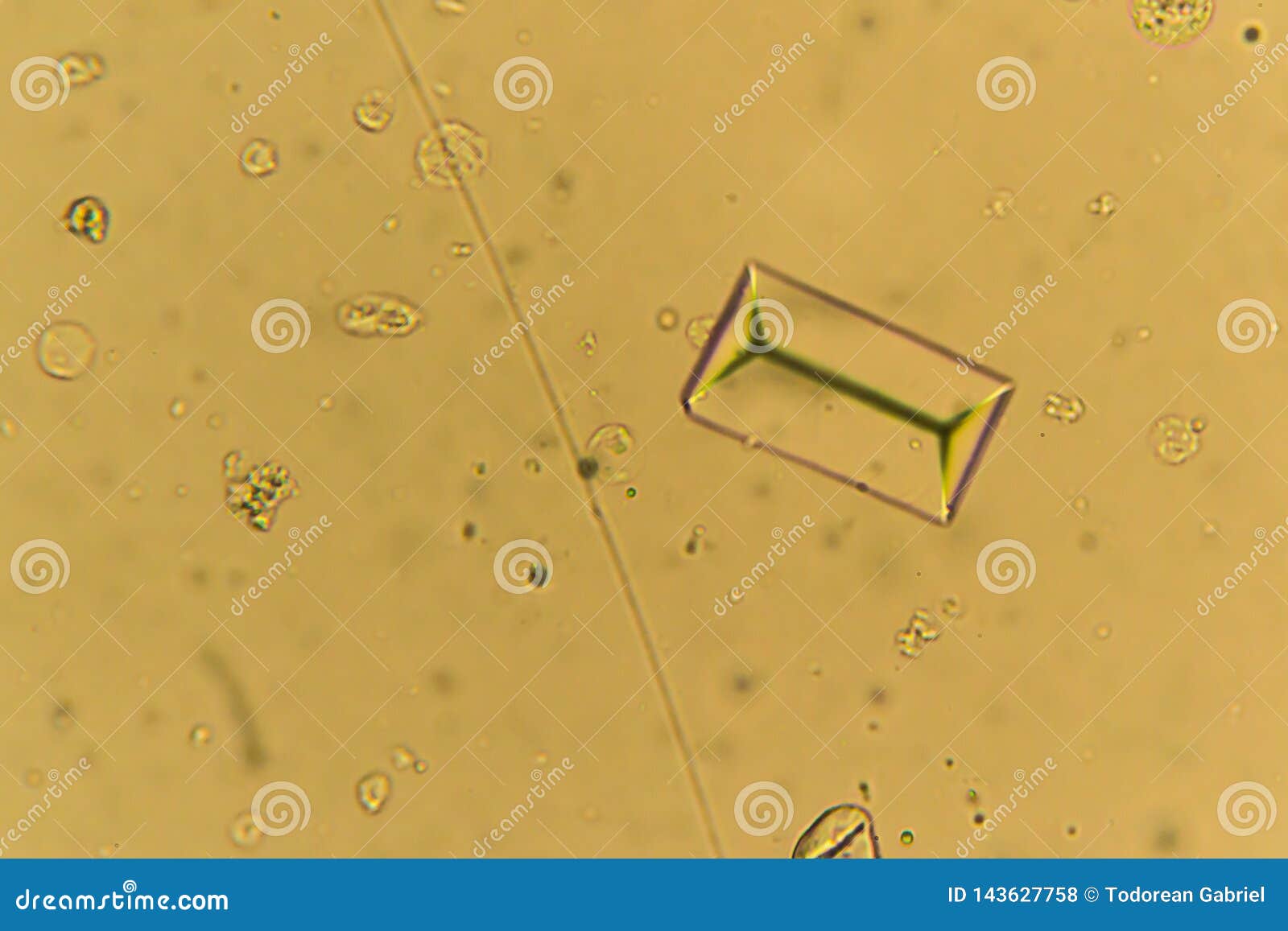 Struvites At The Microscope Royalty-Free Stock Image | CartoonDealer ... Struvites At The Microscope Royalty-Free Stock Image | CartoonDealer ...