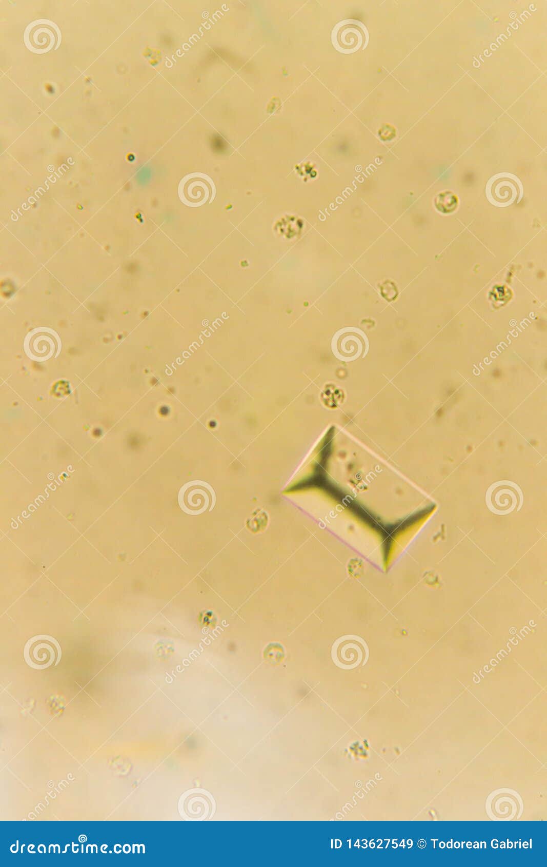 Struvites At The Microscope Royalty-Free Stock Image | CartoonDealer ... Struvites At The Microscope Royalty-Free Stock Image | CartoonDealer ...