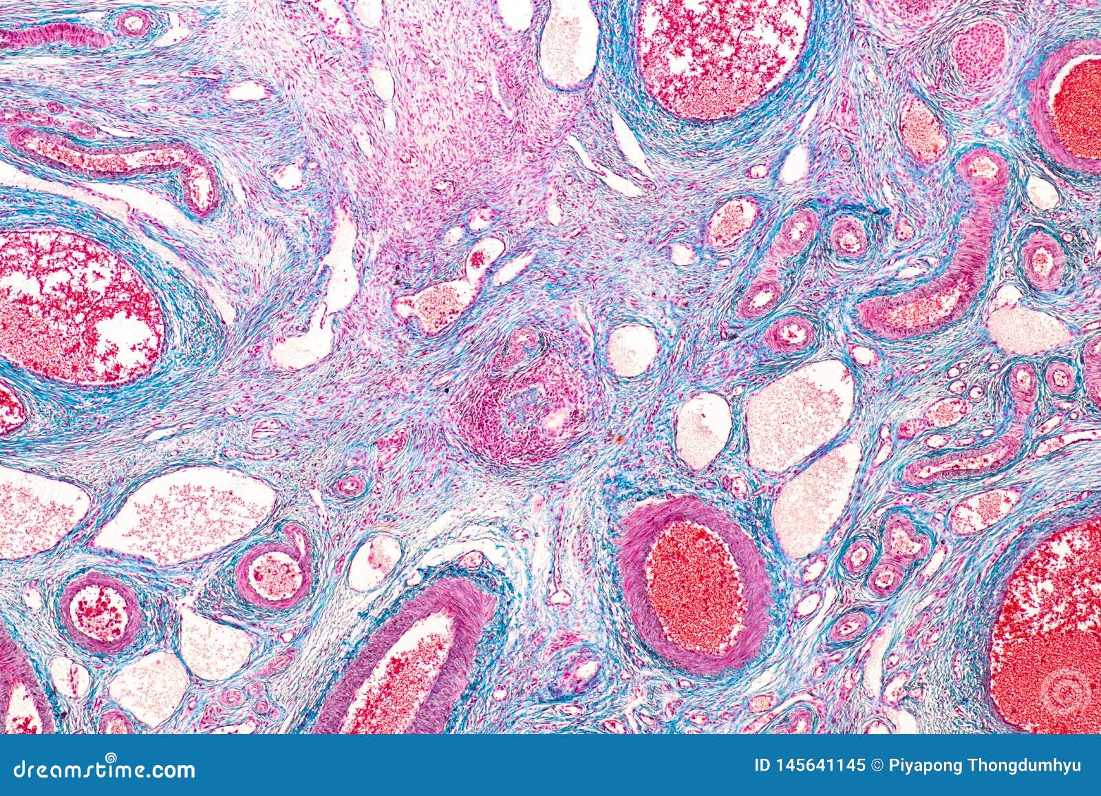 Student Learning Anatomy and Physiology of Ovary Under the Microscopic ...